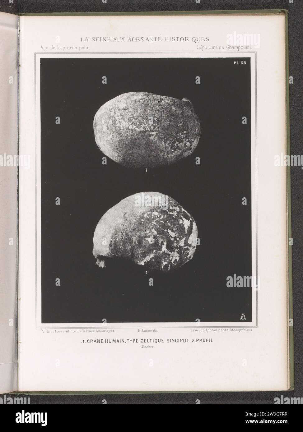 Two views of a human skull, top view and and profil, c. 1860 - in or ...