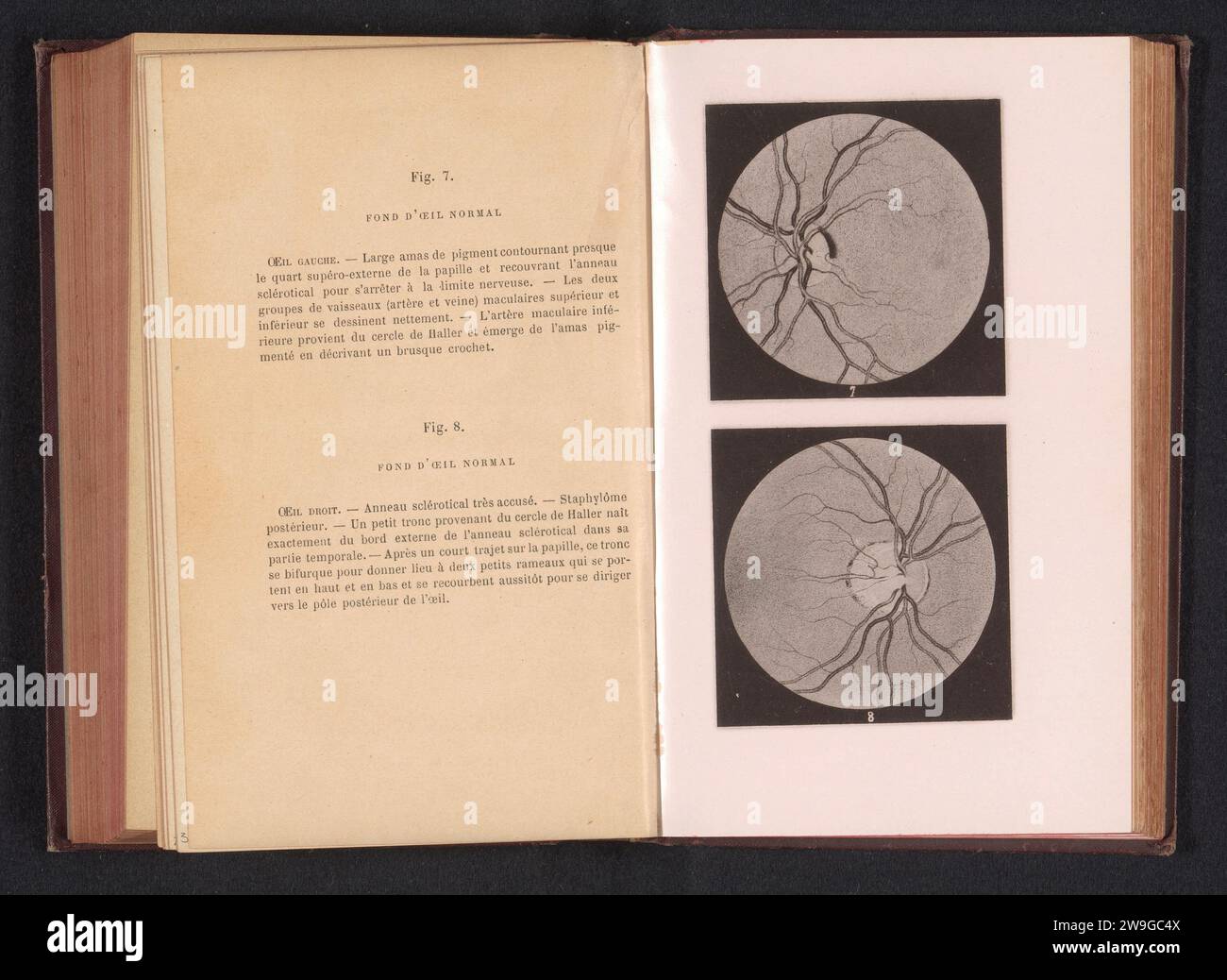 Photo production of two anatomical drawings of a normal eye, anonymous ...