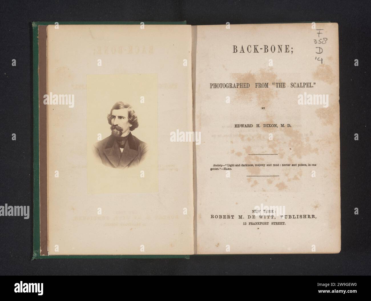 Back-bone photographed from "the scalpel", Edward H. Dixon, 1866 book ...