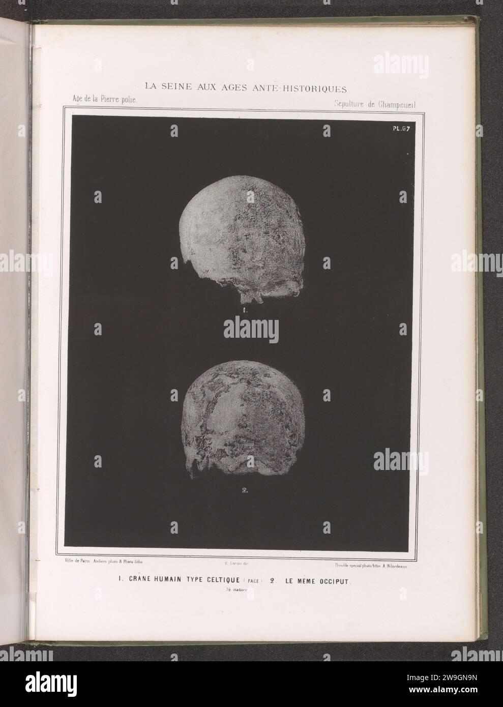Two views of a human skull, front and back, c. 1860 - in or before 1869 ...