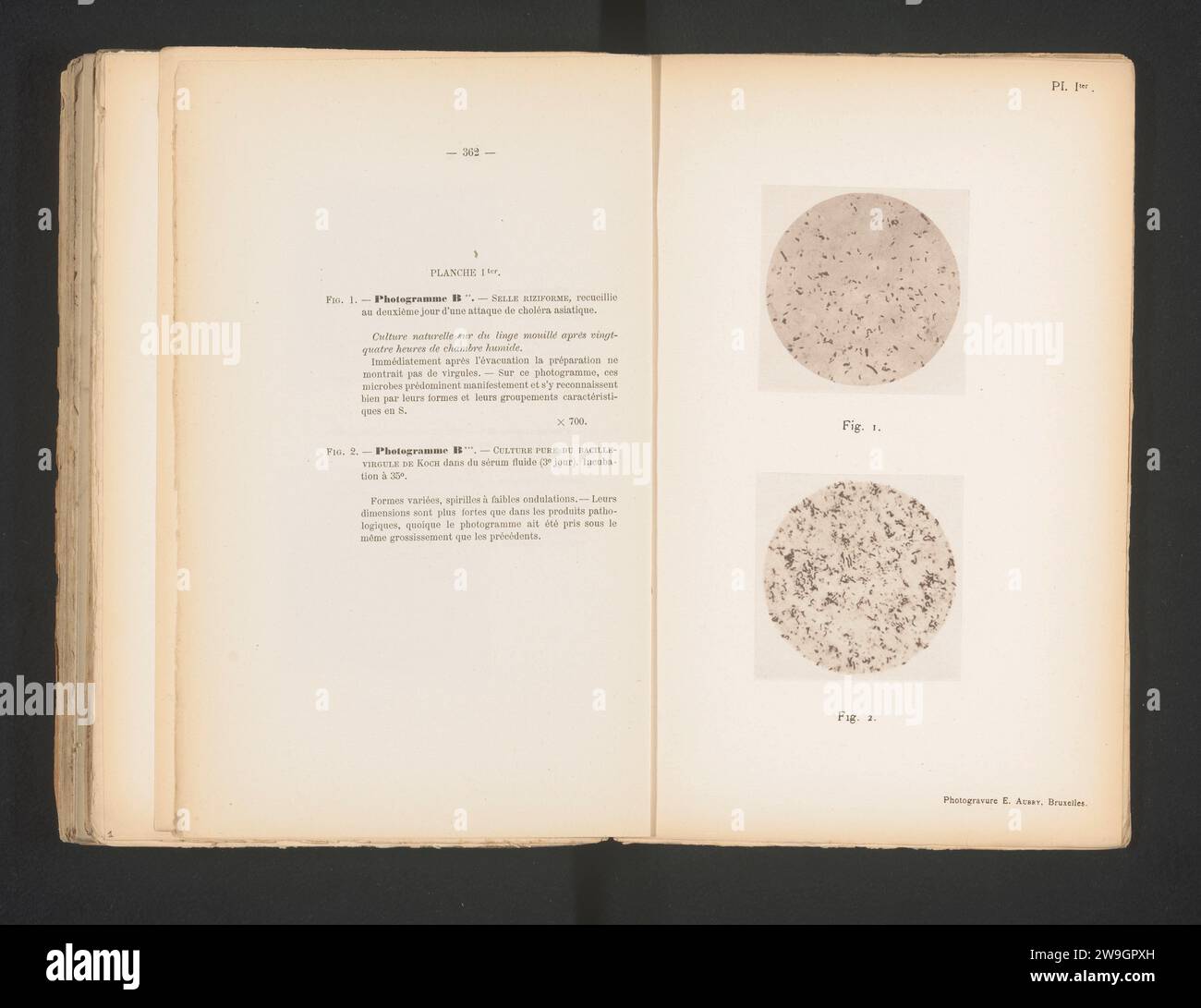 Two microscope recordings from Cholera, Émile van Ermemgem, c. 1875 ...