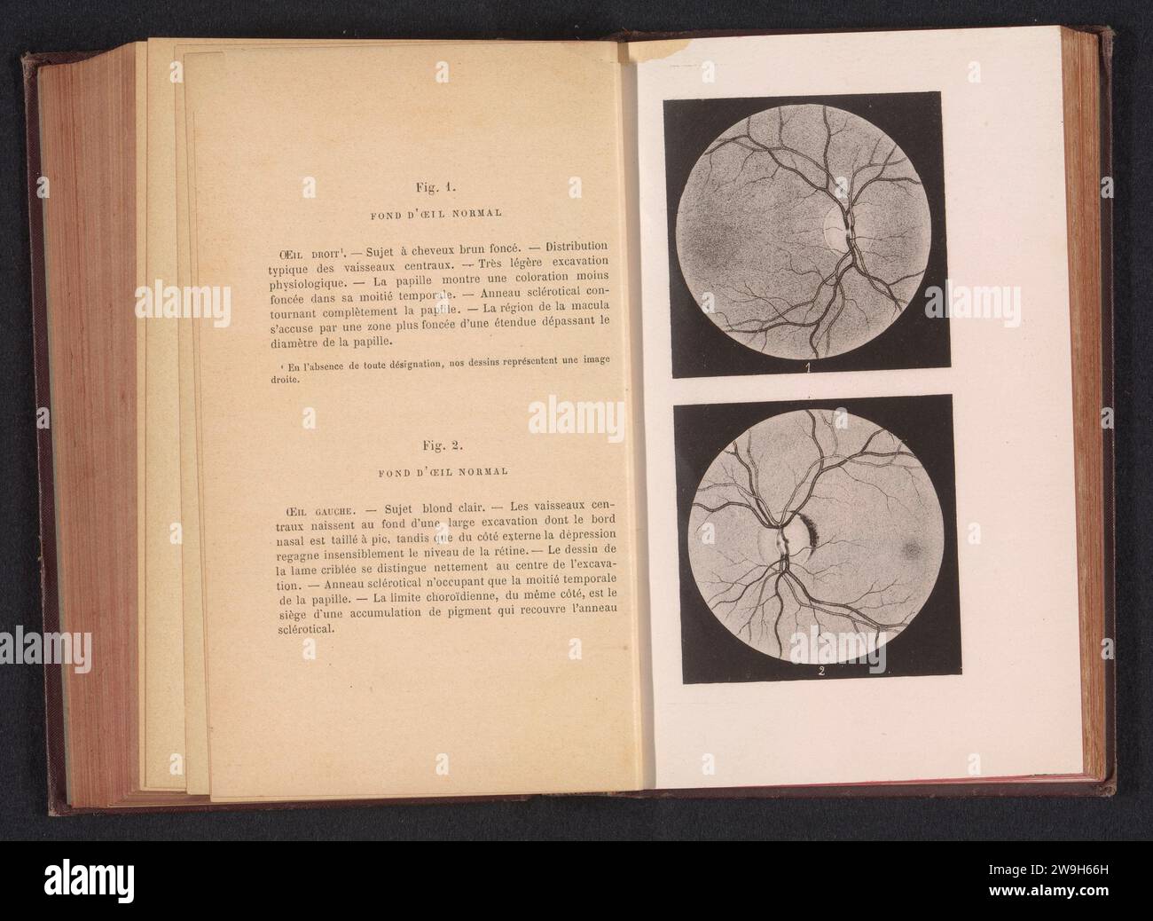 Photo production of two anatomical drawings of a normal eye, anonymous ...