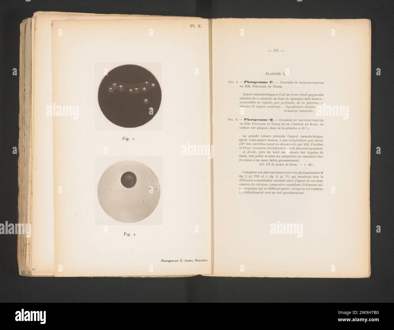 Two microscope recordings from Cholera, Émile van Ermemgem, c. 1875 ...