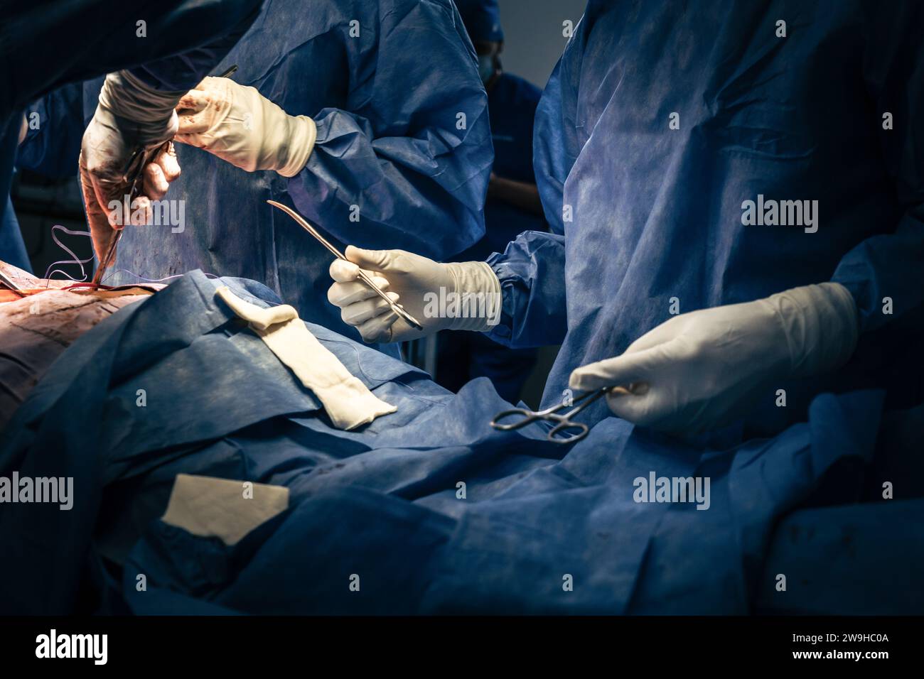 Surgeons and instrumental assistant are performing a surgical operation ...