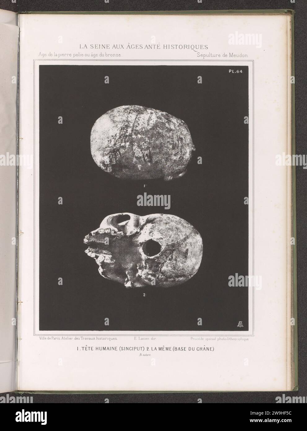 Two views of a human skull, top view and skull base, c. 1860 - in or ...