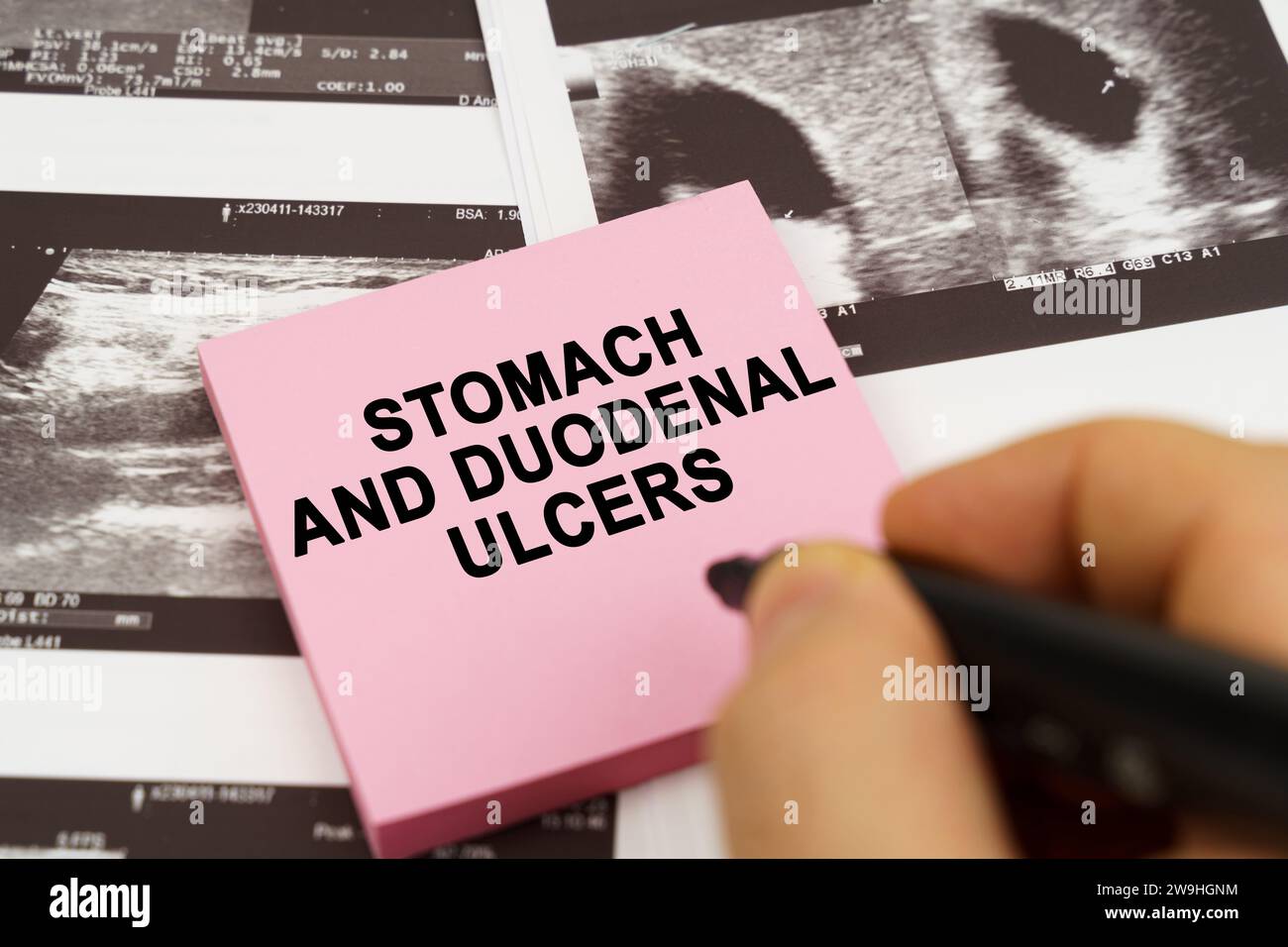 Medical concept. On the ultrasound pictures there are stickers that say ...