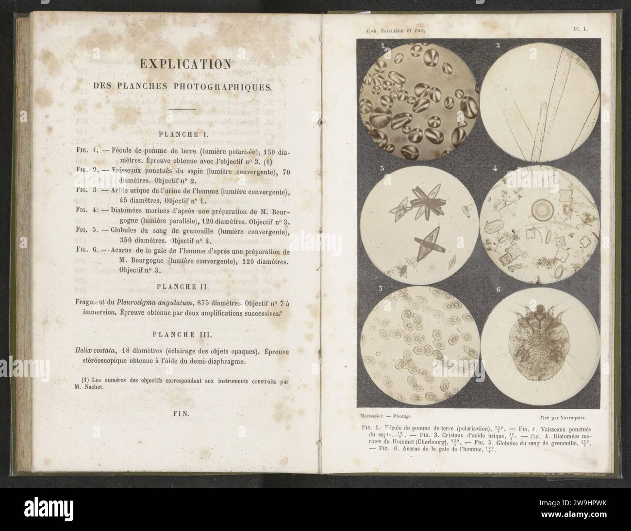 Six micro recordings of cells, Albert Moitessier, c. 1856 - in or ...