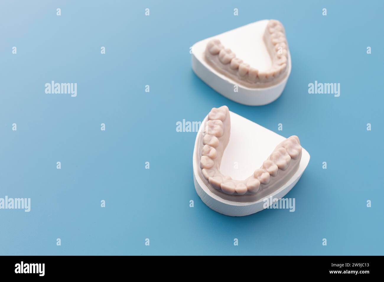 Gypsum Model Plaster For Teeth Molar, Dental Mold In Laboratory On Blue ...