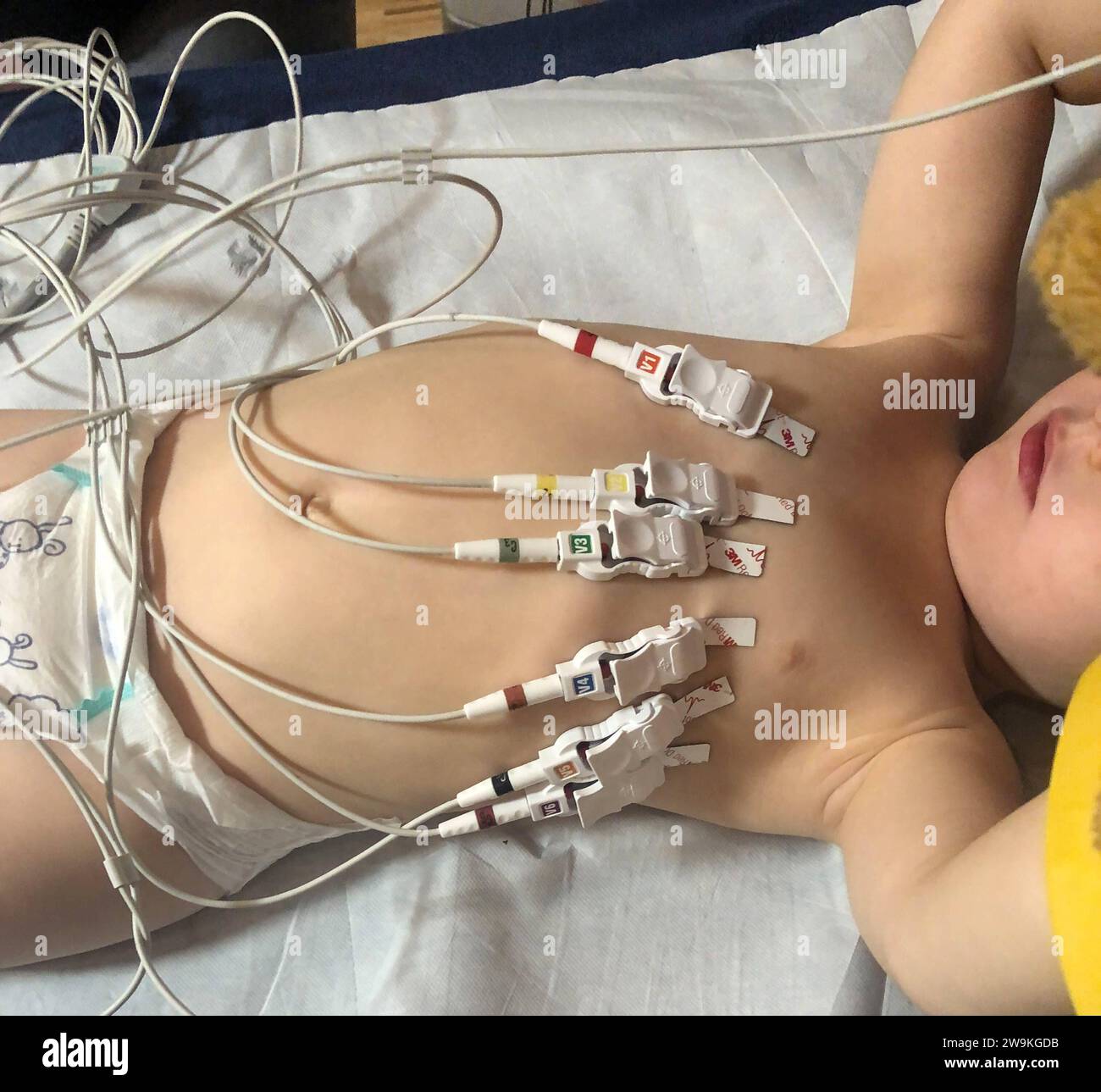 Ein kleiner Junge erhaelt ein EKG in der Praxis eines Kinderkardiolgen, Freiburg. . *** A little ...