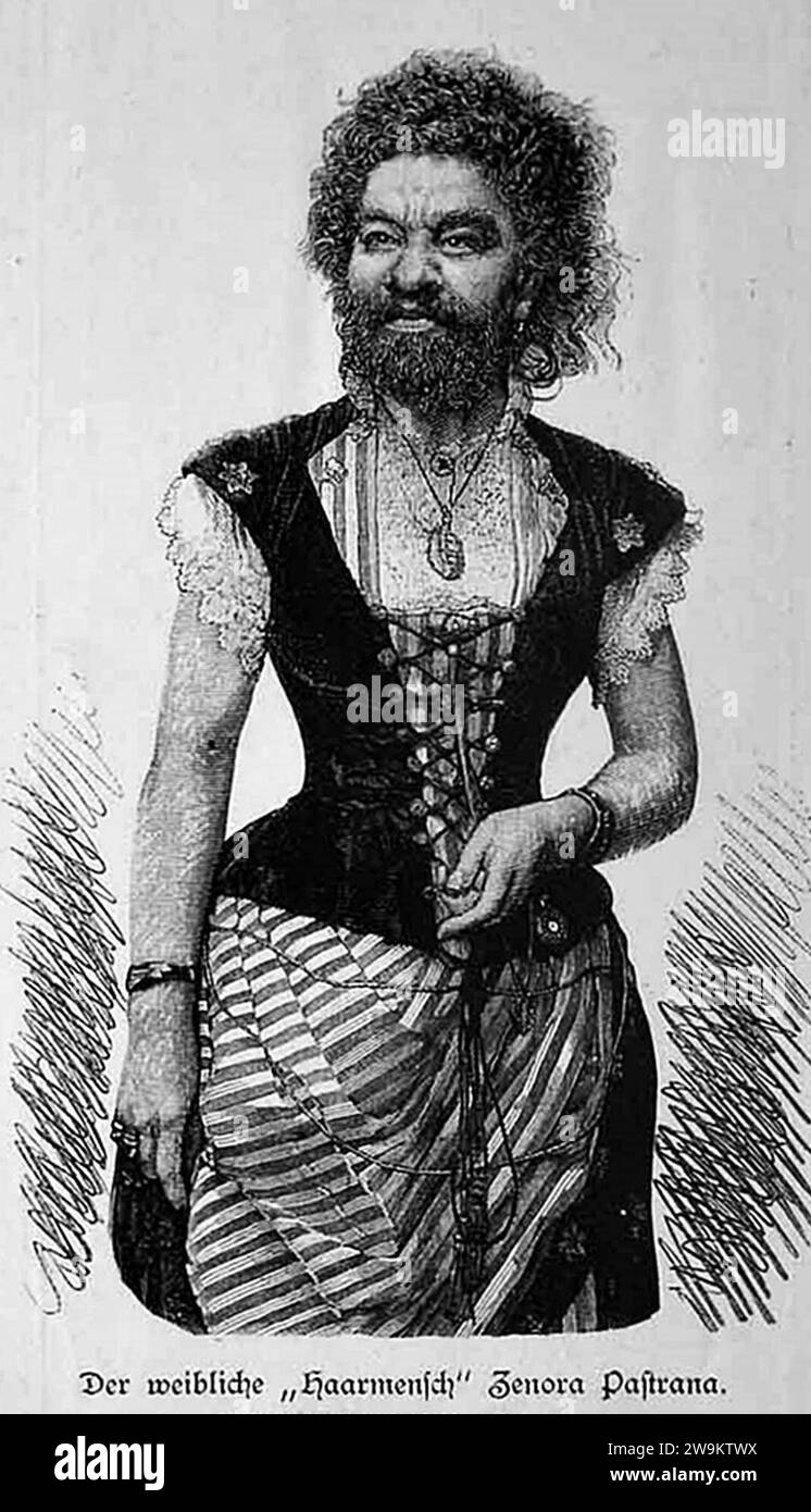 Zirkus Zenora Pastrana Stock Photo - Alamy