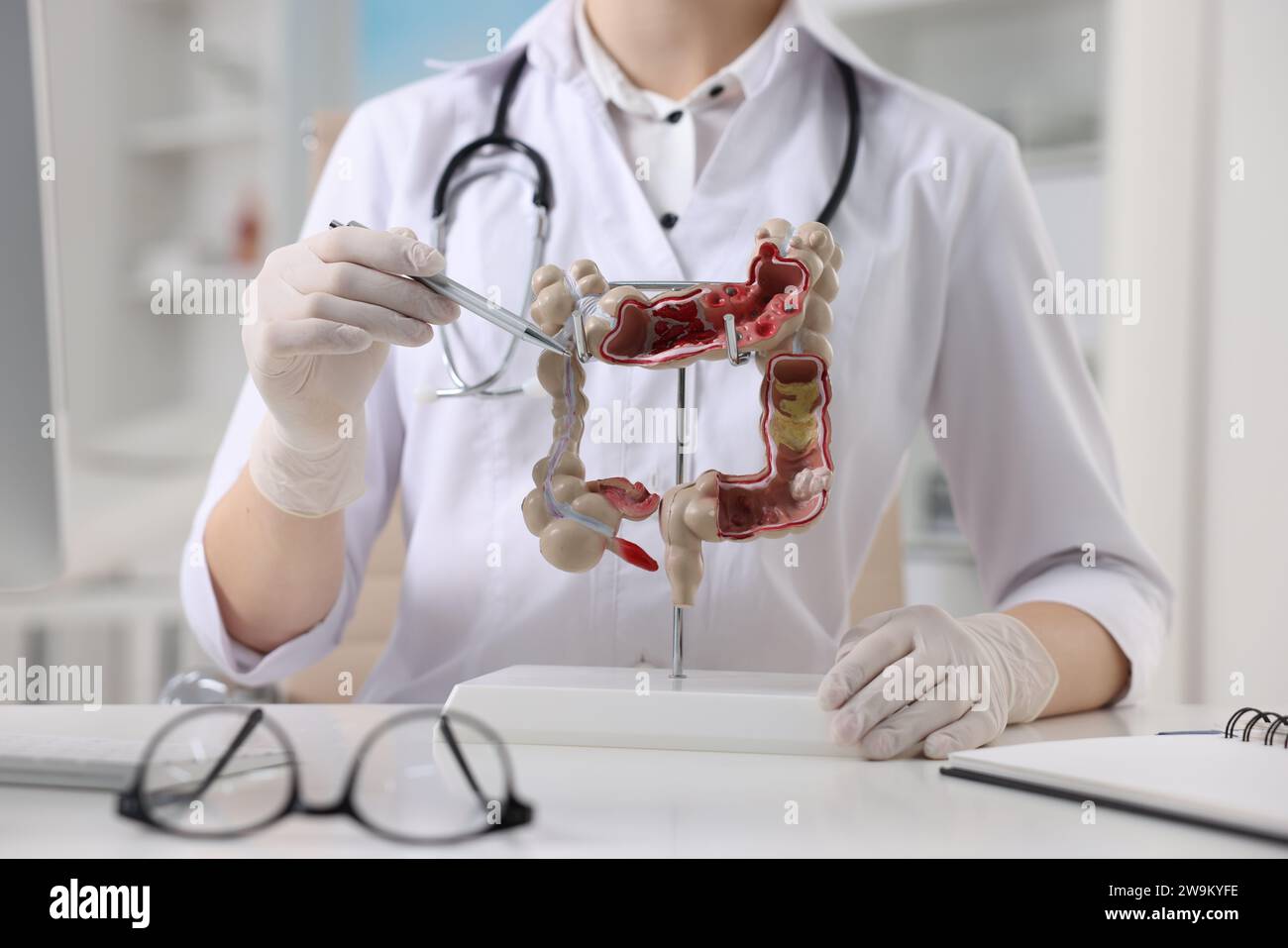 Gastroenterologist showing anatomical model of large intestine at table ...