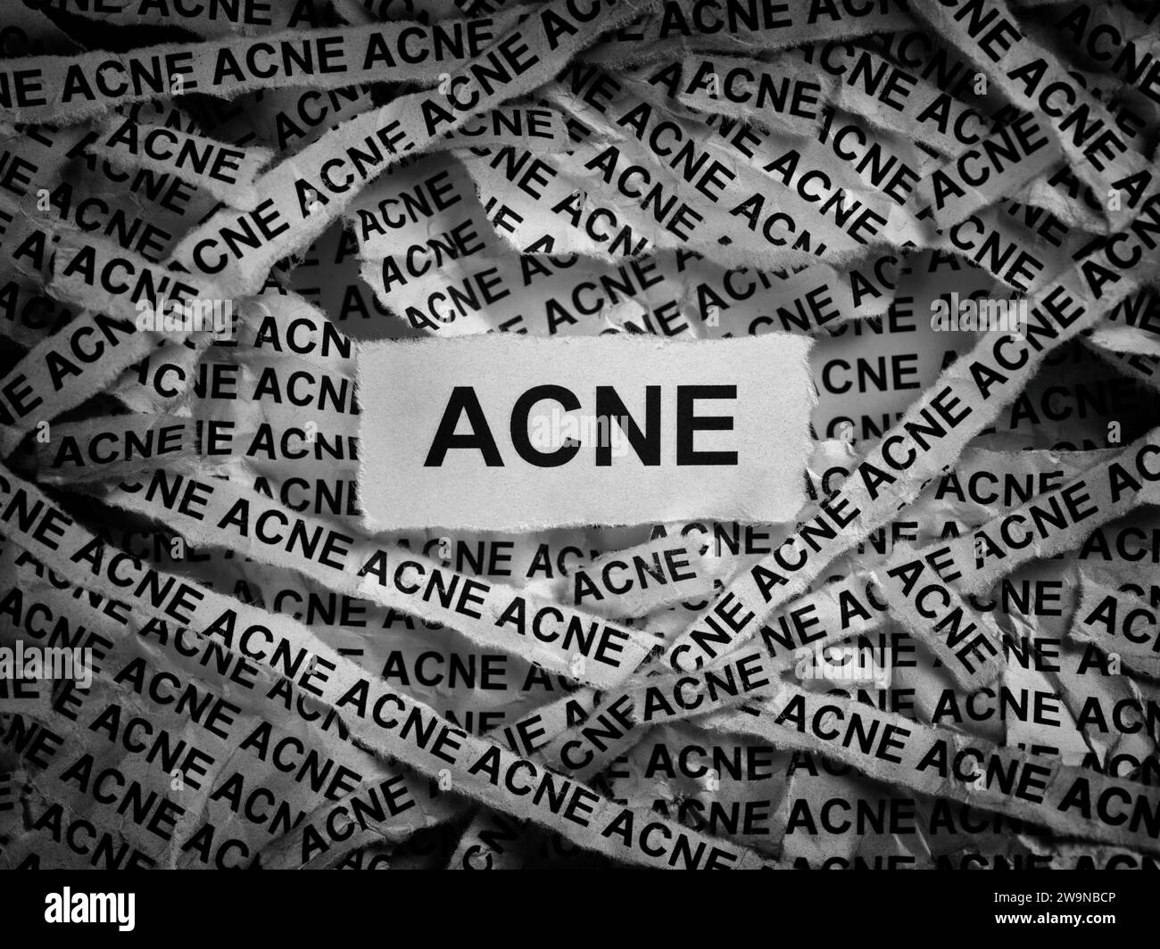 Skin cell hi-res stock photography and images - Alamy