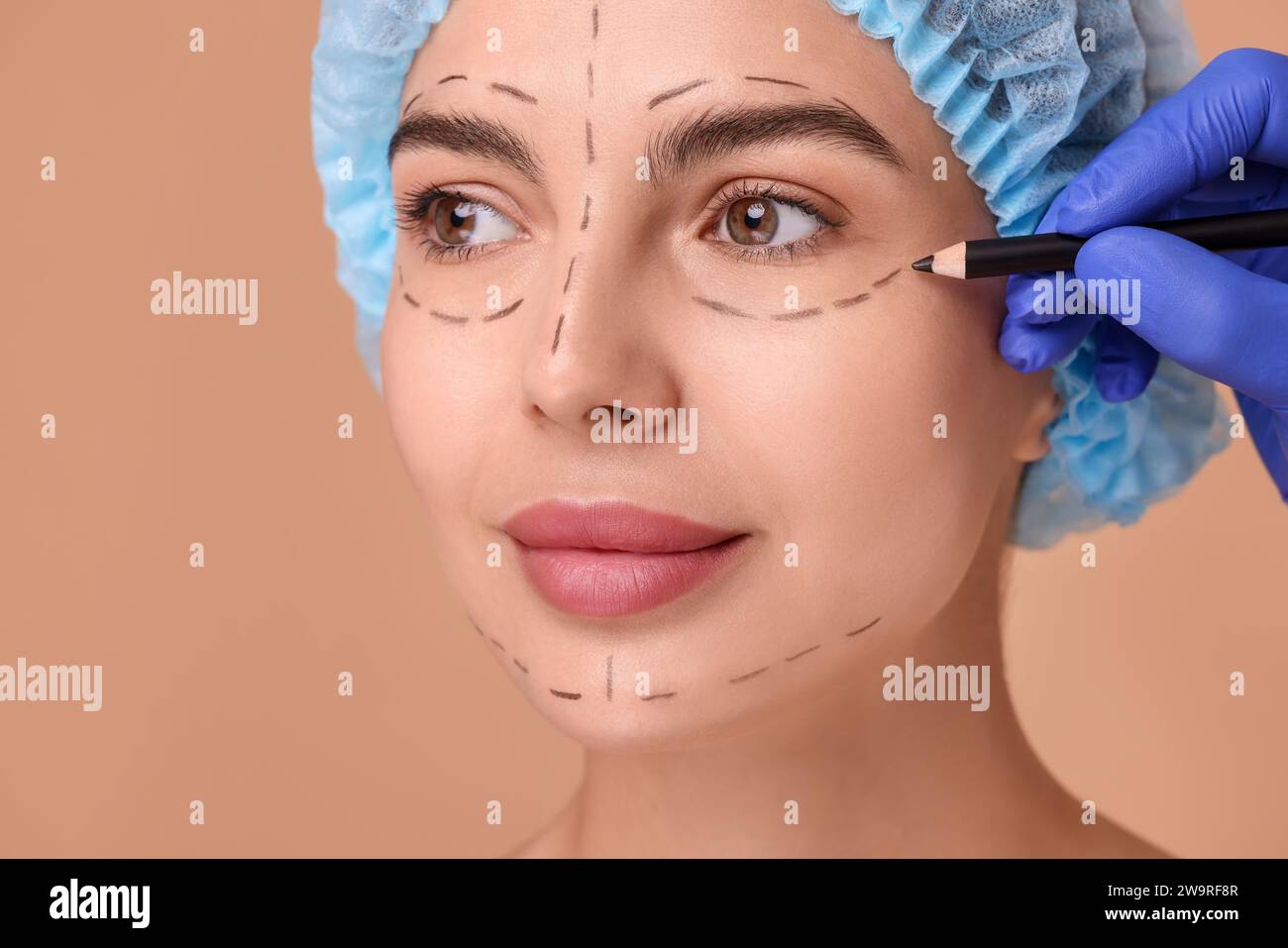 Doctor drawing marks on woman's face for cosmetic surgery operation ...