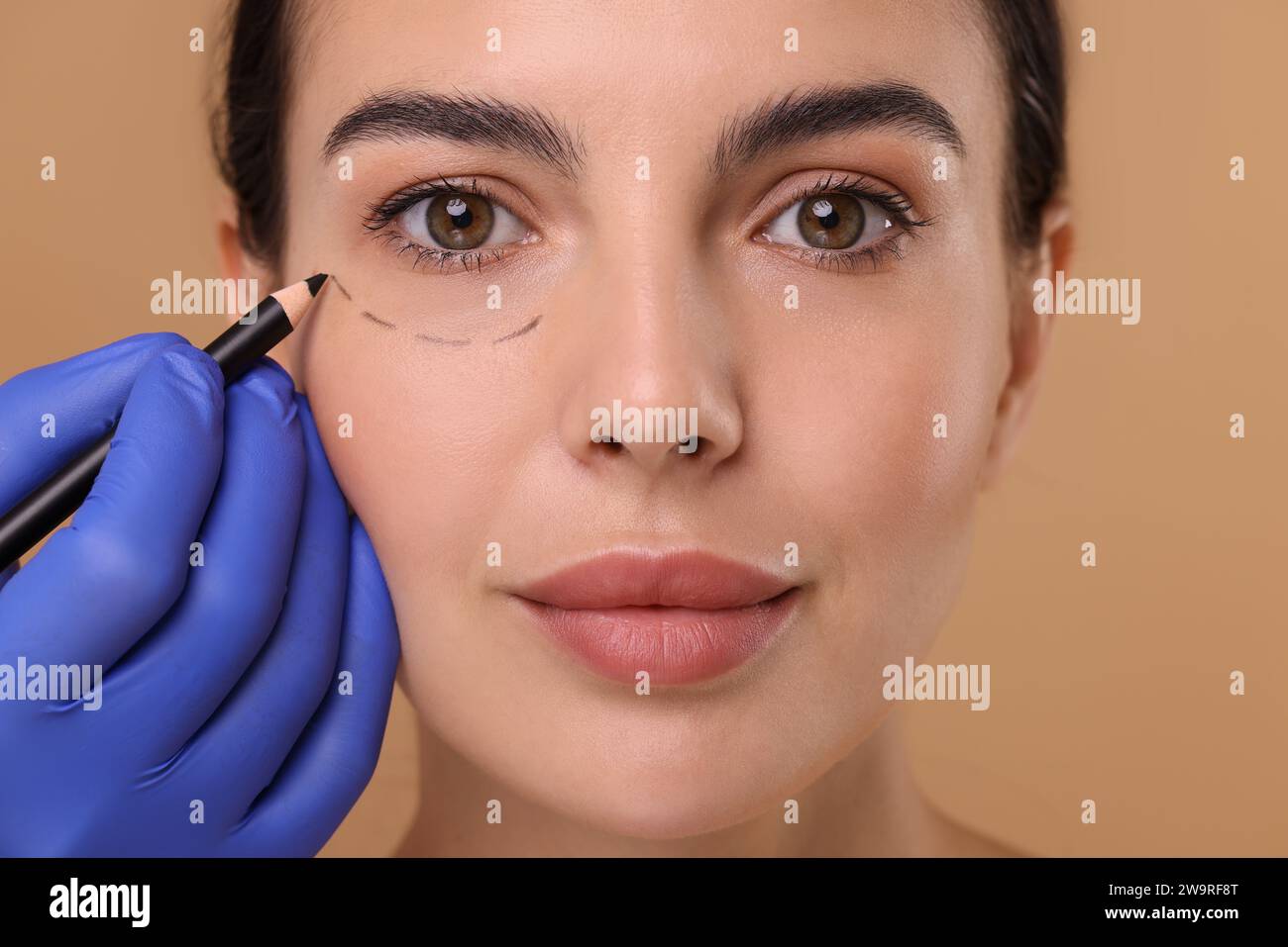 Doctor drawing marks on woman's face for cosmetic surgery operation ...