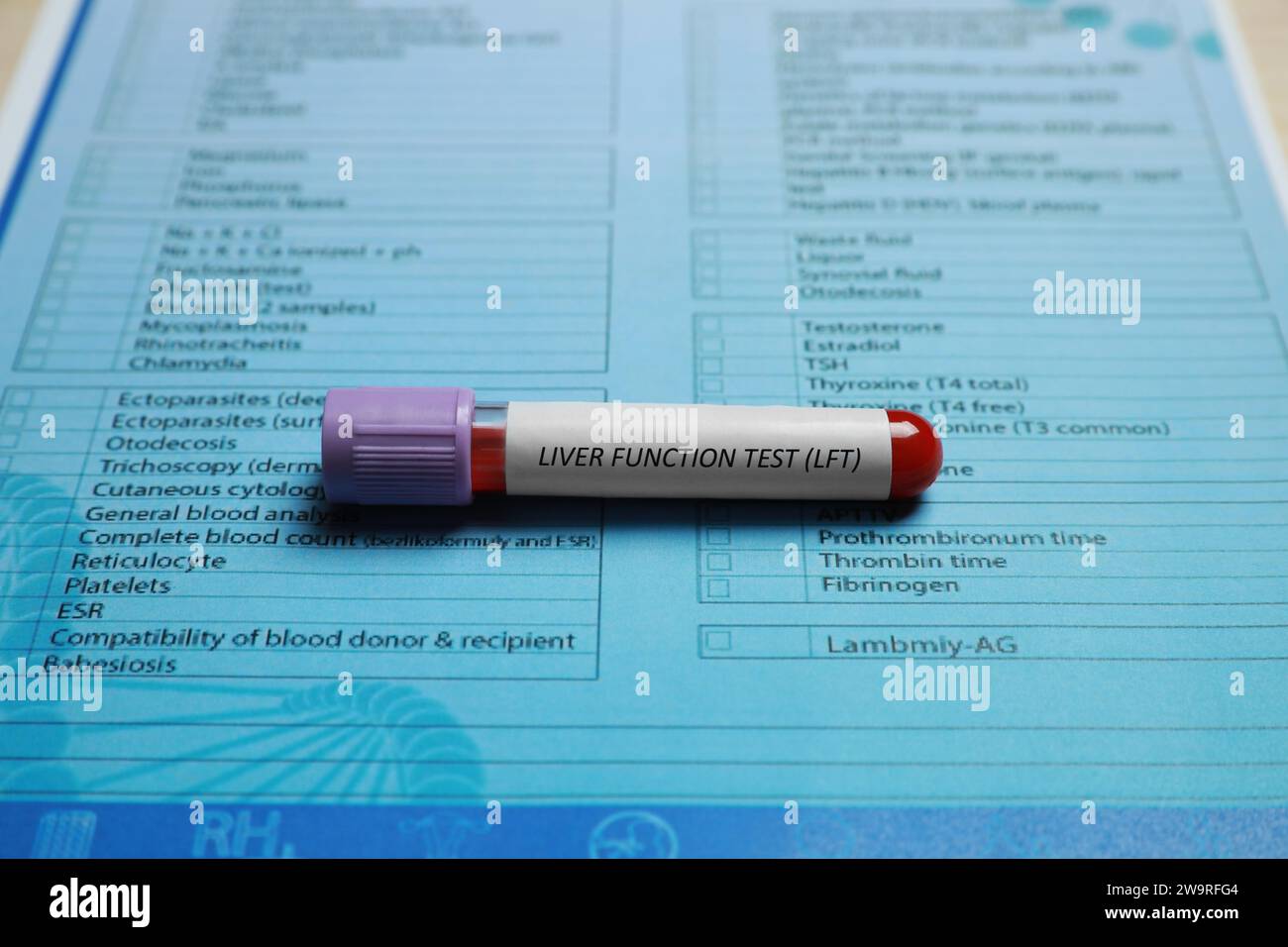 Liver Function Test. Tube with blood sample and laboratory form on ...