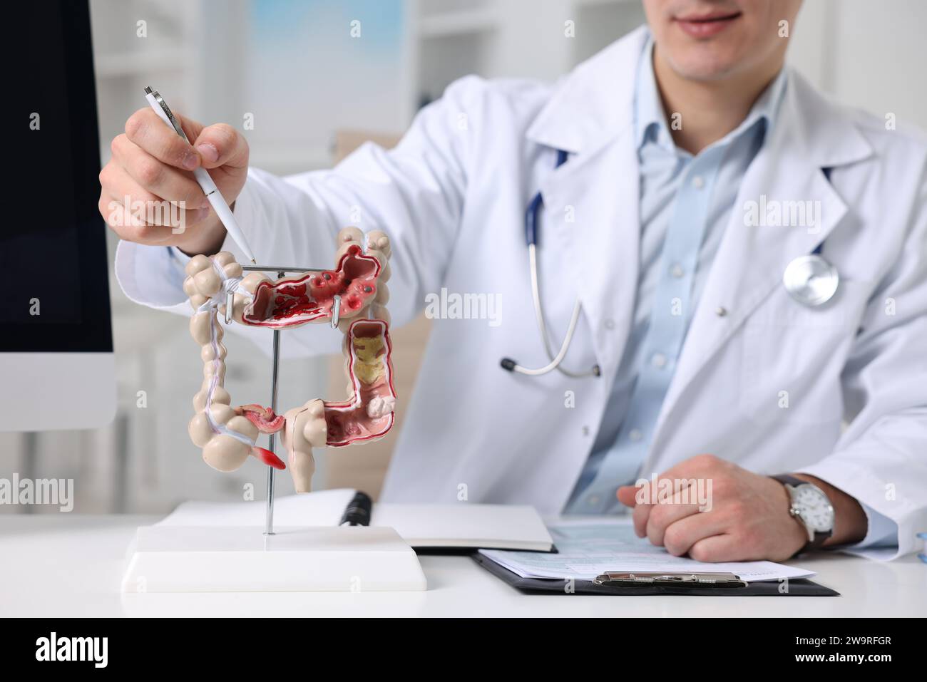 Gastroenterologist showing anatomical model of large intestine at table ...