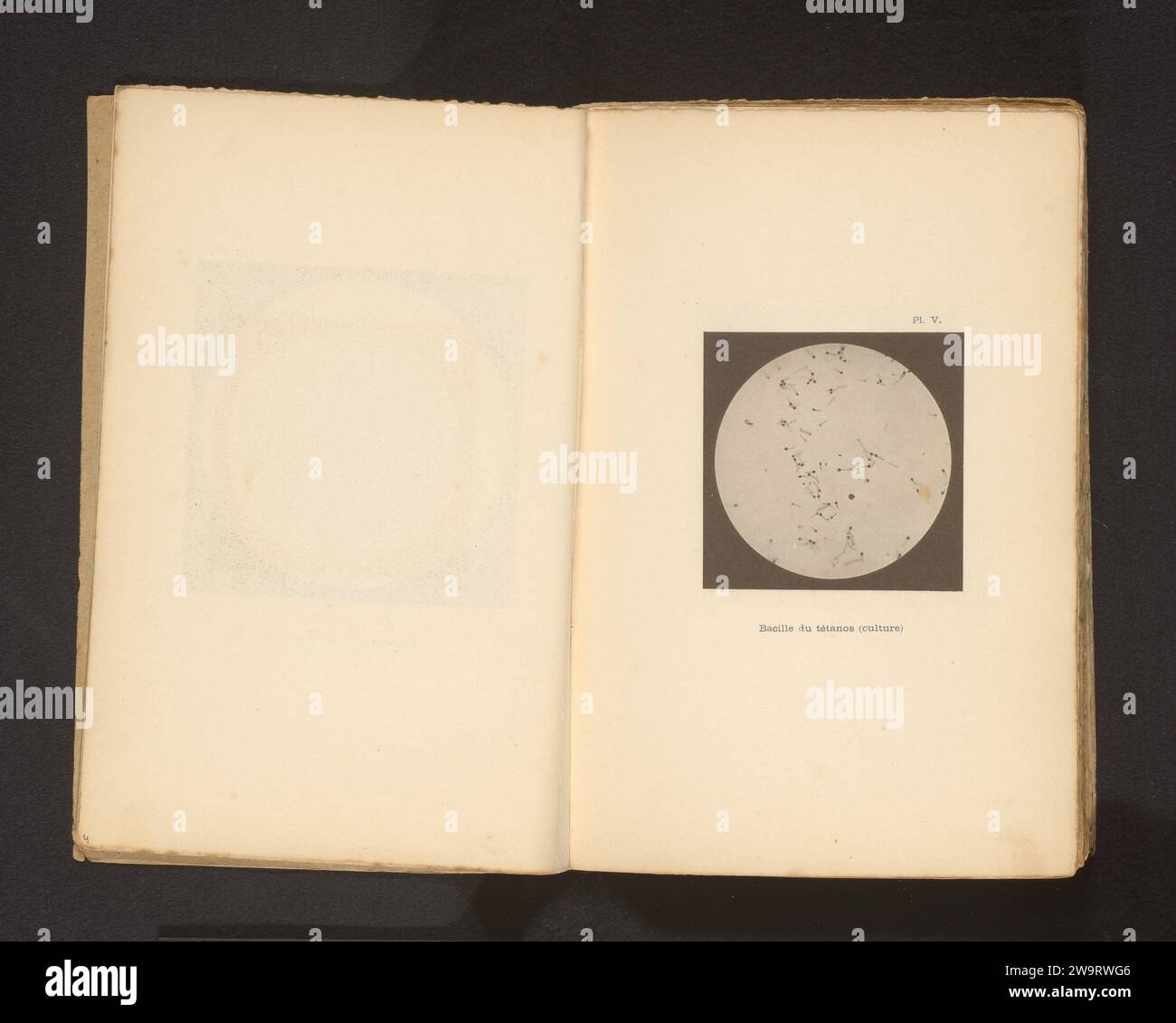 Tetanus bacteria hi-res stock photography and images - Alamy