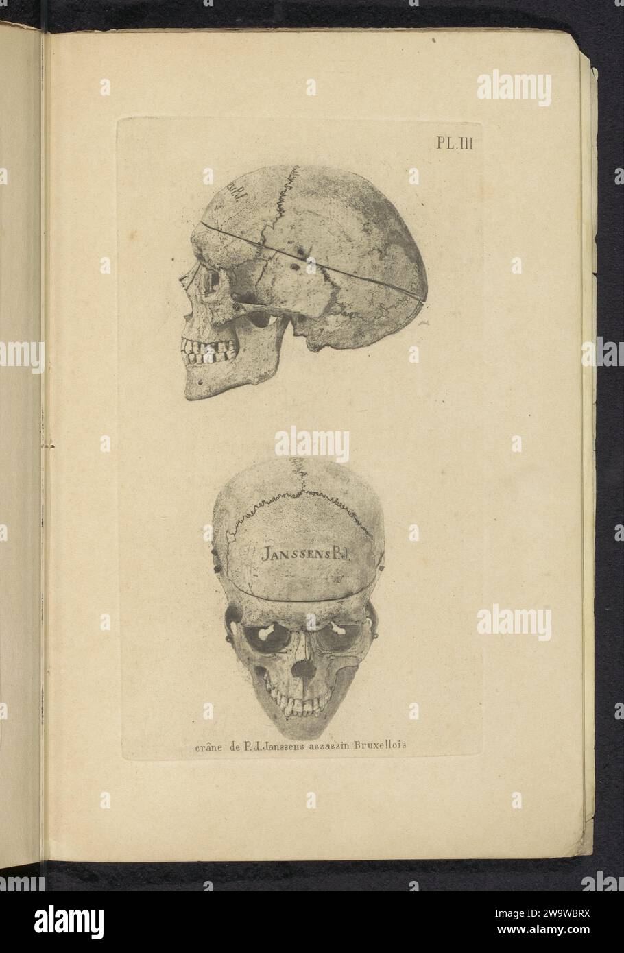 Two views of the skull of P.J. Janssens, Anonymous, c. 1871 - In or ...