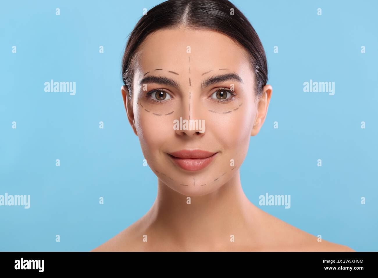 Young woman with marks on face for cosmetic surgery operation against ...