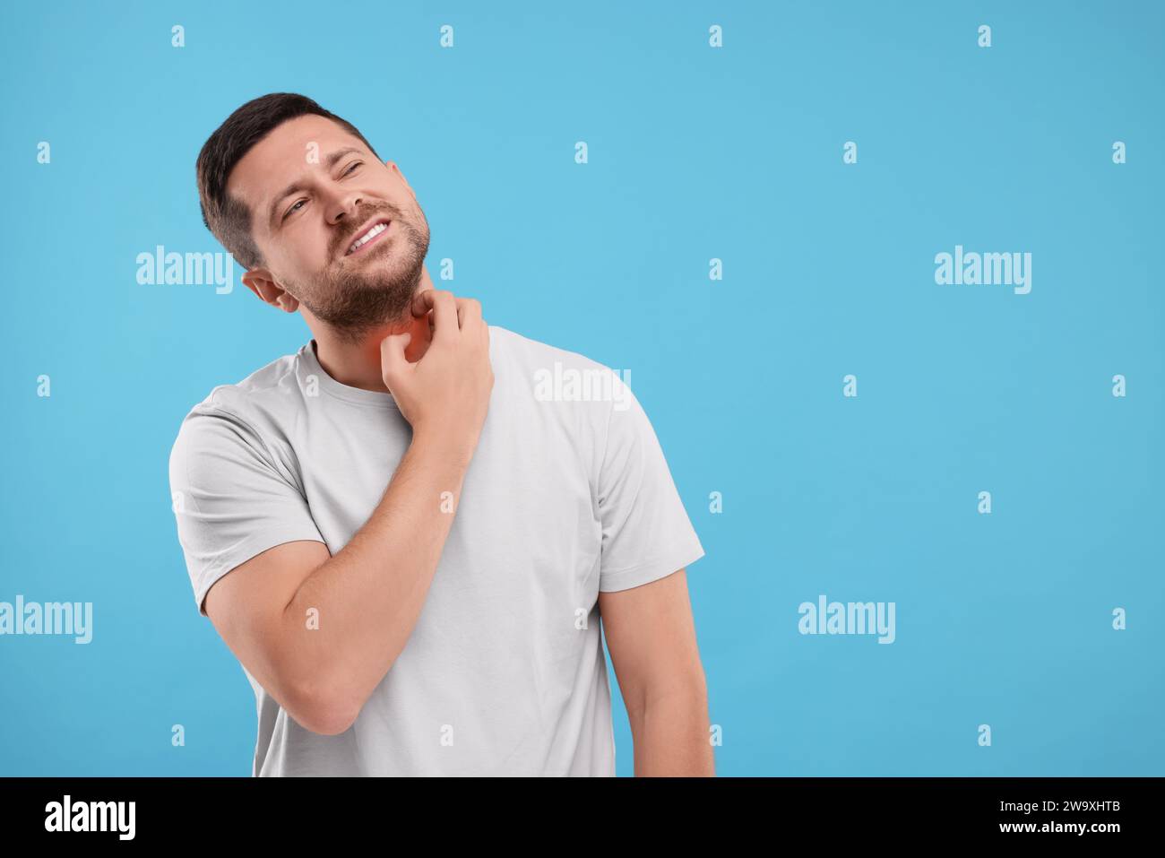 Allergy symptom. Man scratching his neck on light blue background ...