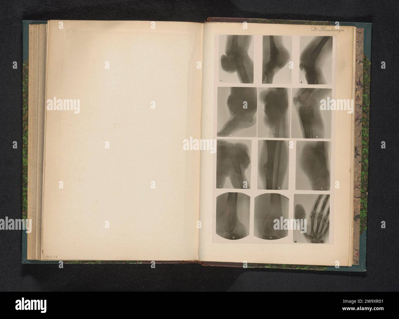 Twelve X -rays of different joints, anonymous, c. 1904 - in or before ...
