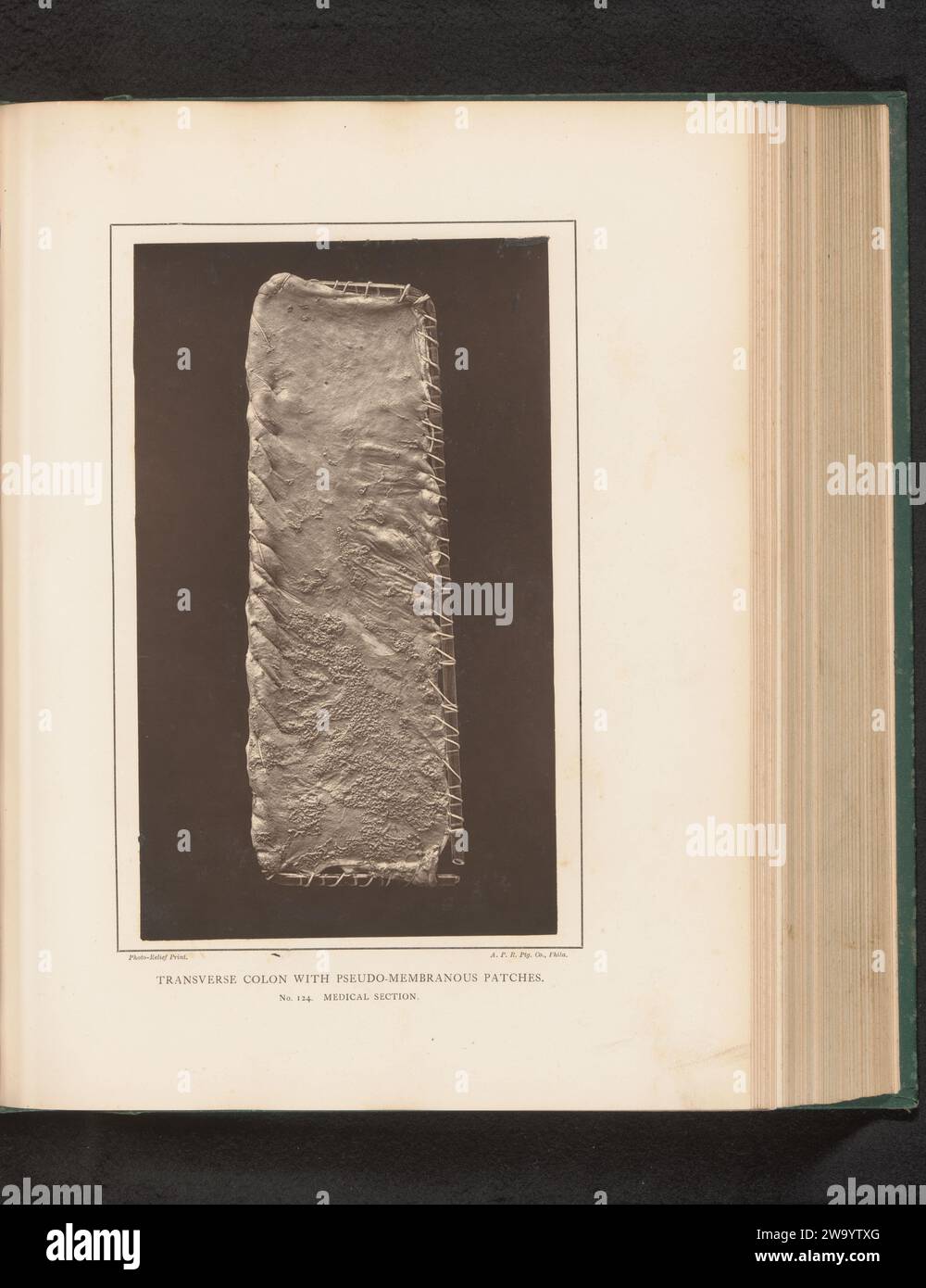 Stretched membranes hi-res stock photography and images - Alamy