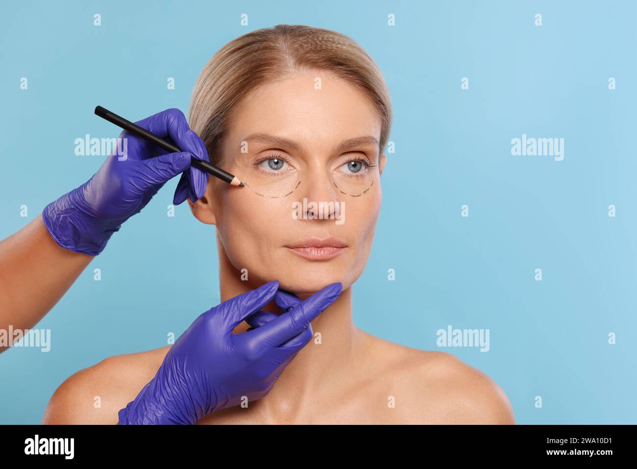 Doctor with pencil preparing patient for cosmetic surgery operation on ...
