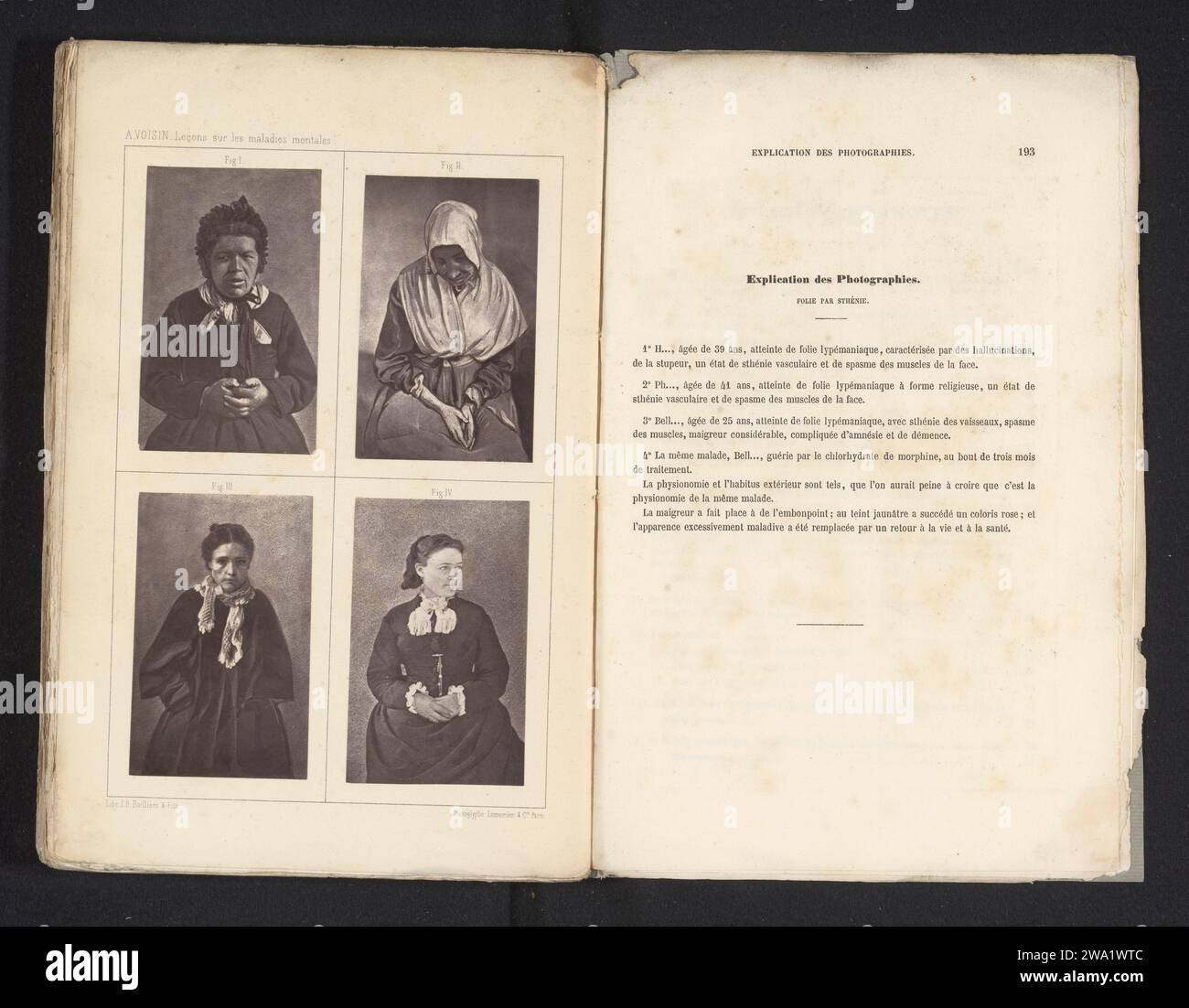 Four portraits of women with a mental illness, anonymous, c. 1866 - in ...