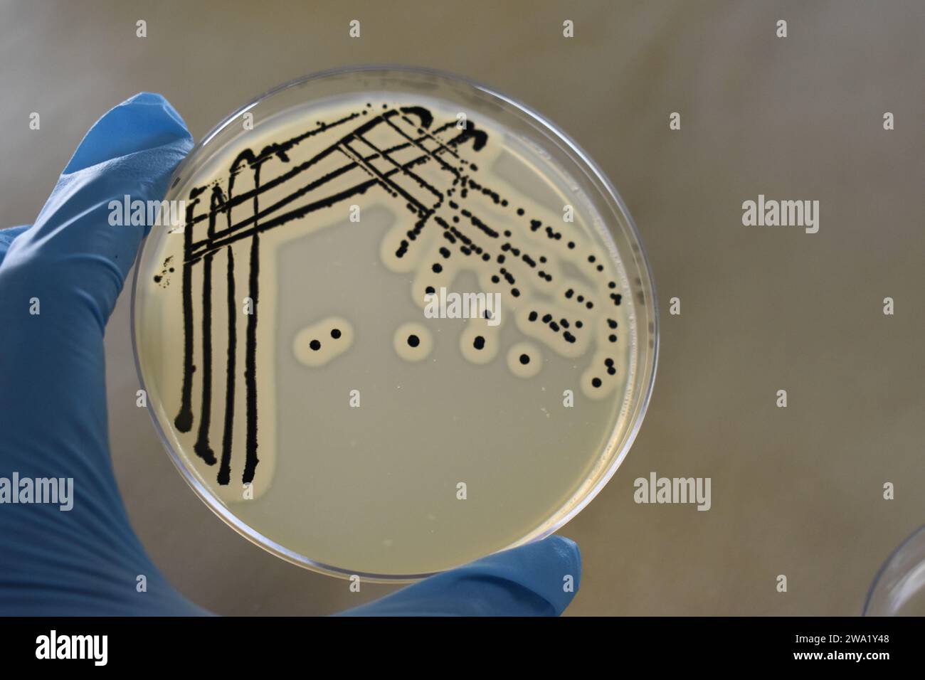 A quadrant streak of the bacterium, Staphylococcus aureus cultured or ...