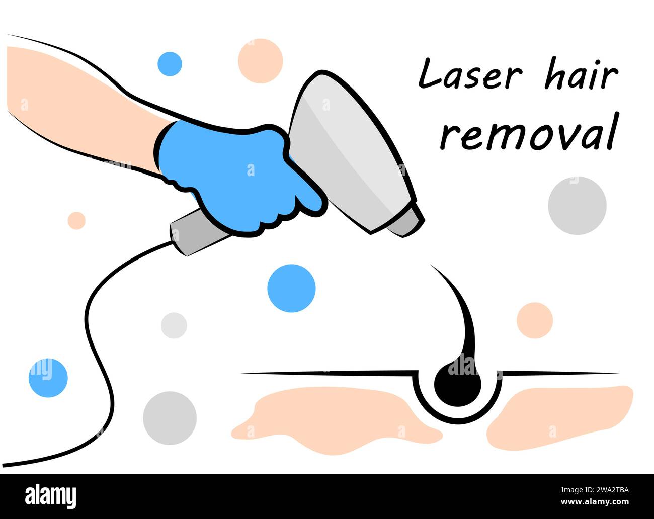 Cosmetic laser treatment armpit hair Cut Out Stock Images & Pictures ...