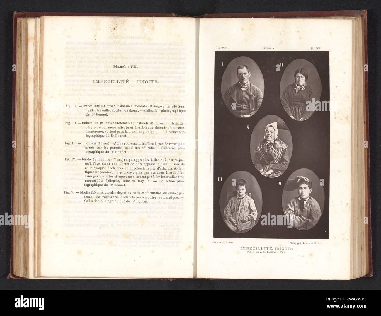 Five portraits of mentally people, J. Valette, c. 1866 - in or before ...