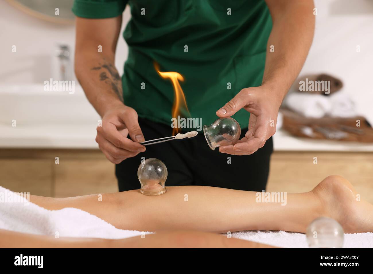 Therapist giving fire cupping treatment to patient in spa salon ...