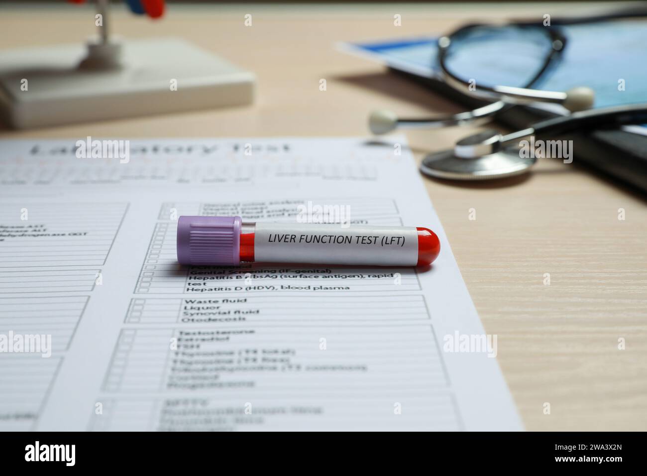 Liver Function Test. Tube with blood sample and laboratory form on ...