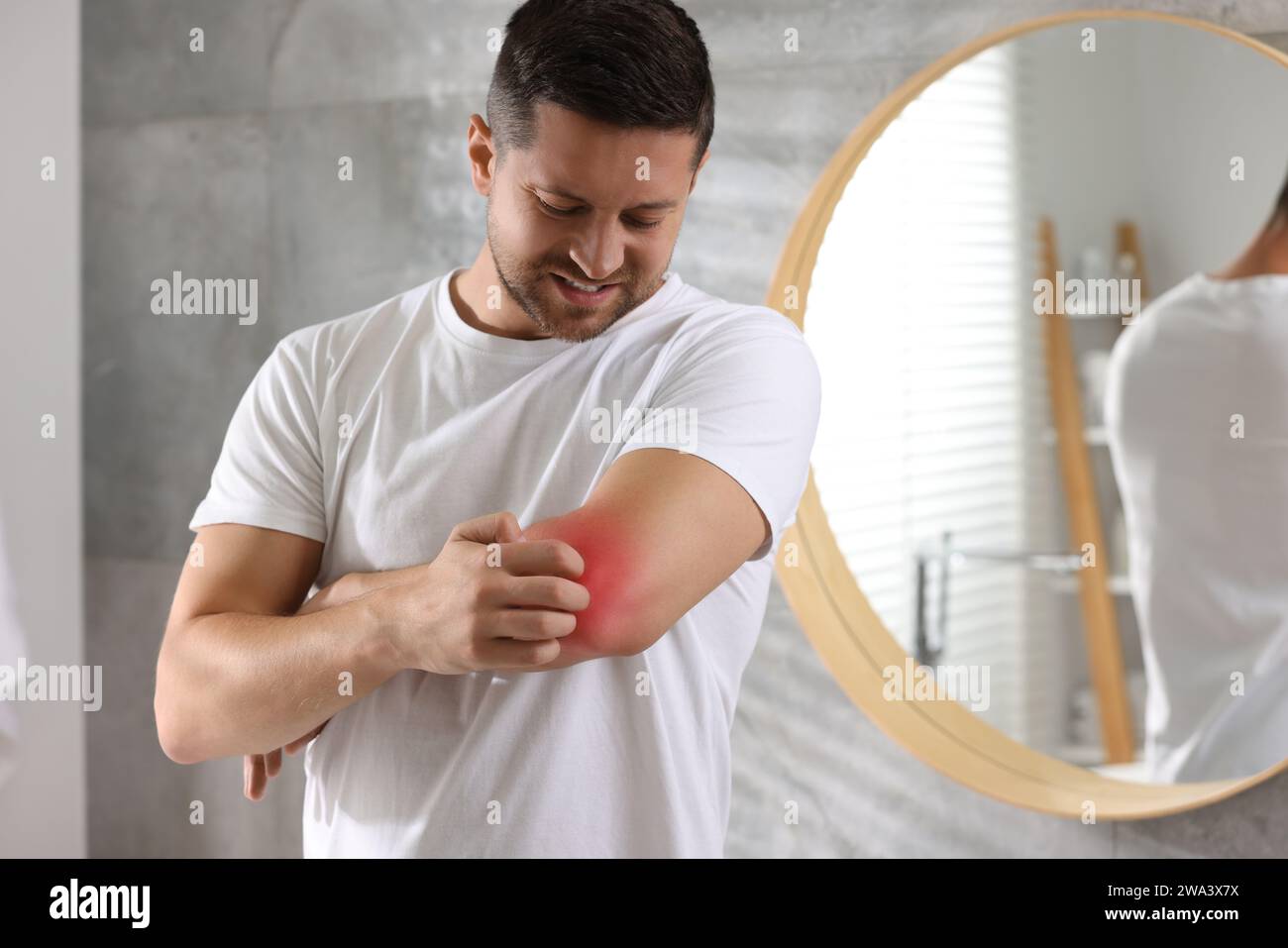 Man suffering from allergy scratching his arm indoors Stock Photo - Alamy