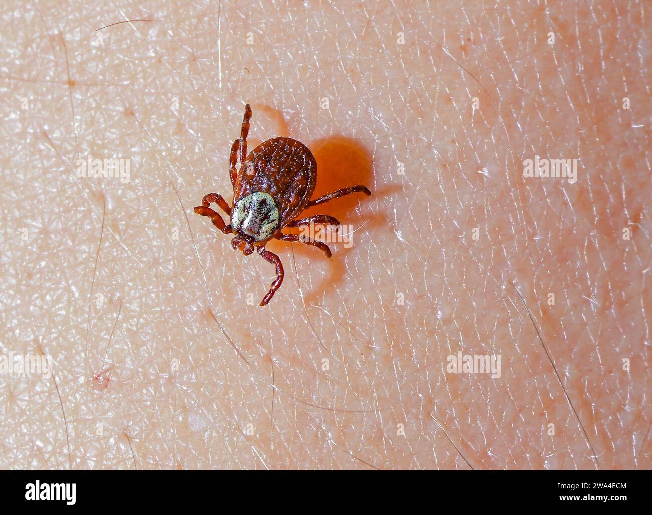 Sieversdorf, Germany. 01st Jan, 2024. A tick (Ixodida) can be seen on ...