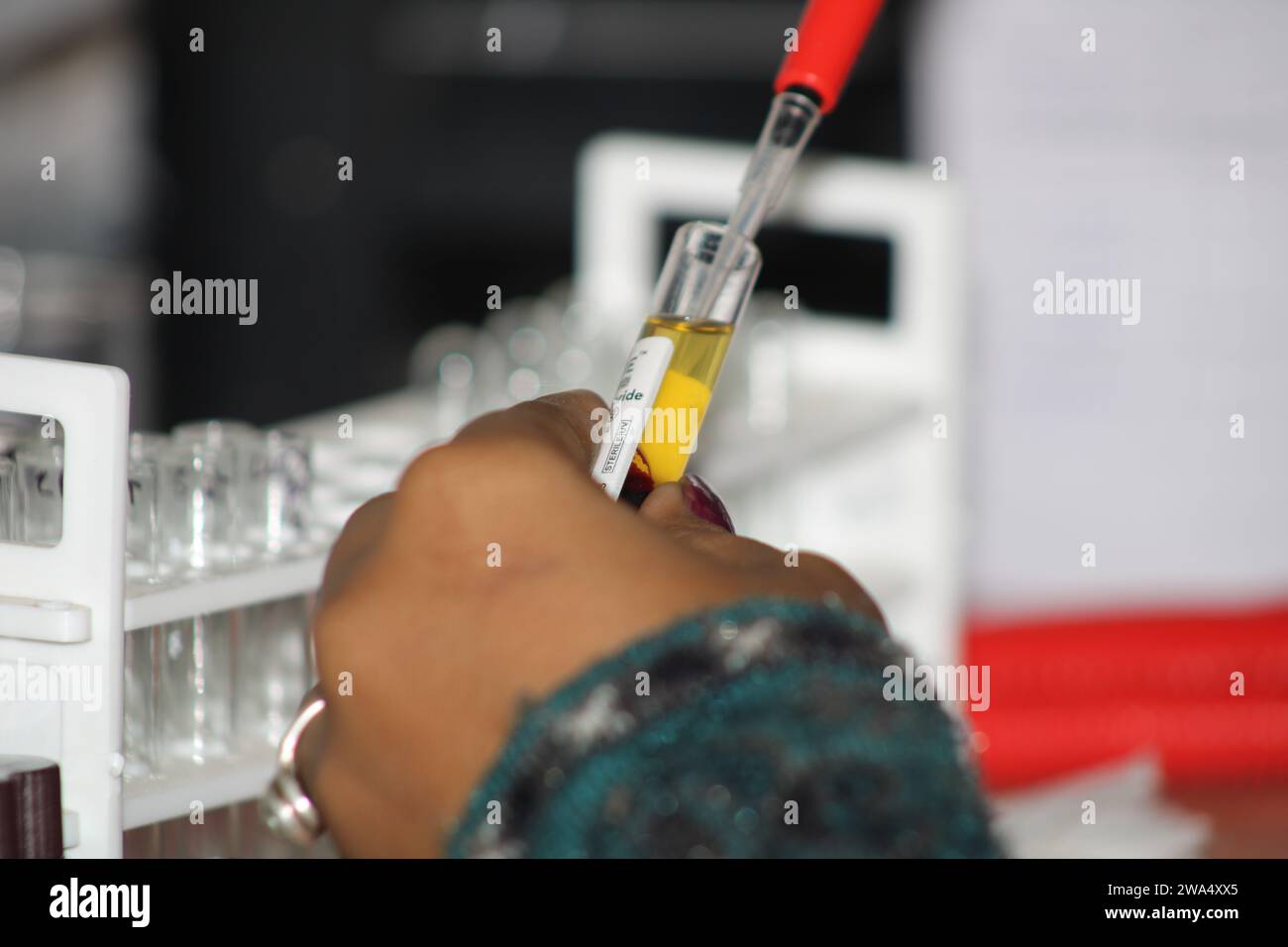 Pathologist withdrawing serum with pipette tips. India Stock Photo - Alamy