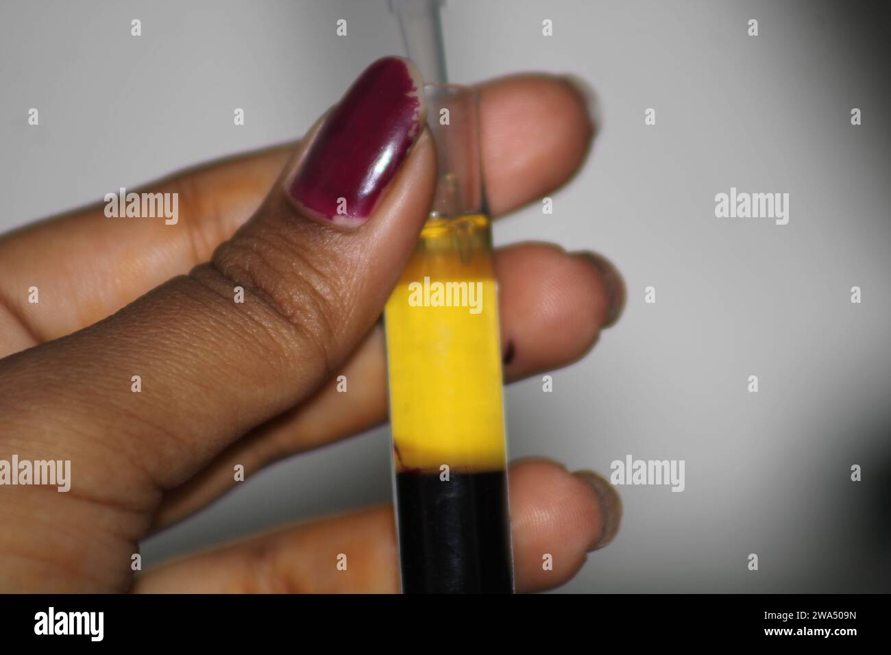 Pathologist withdrawing serum with pipette tips. India Stock Photo - Alamy