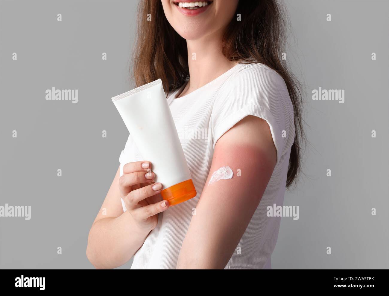 Dermatitis solar hi-res stock photography and images - Alamy