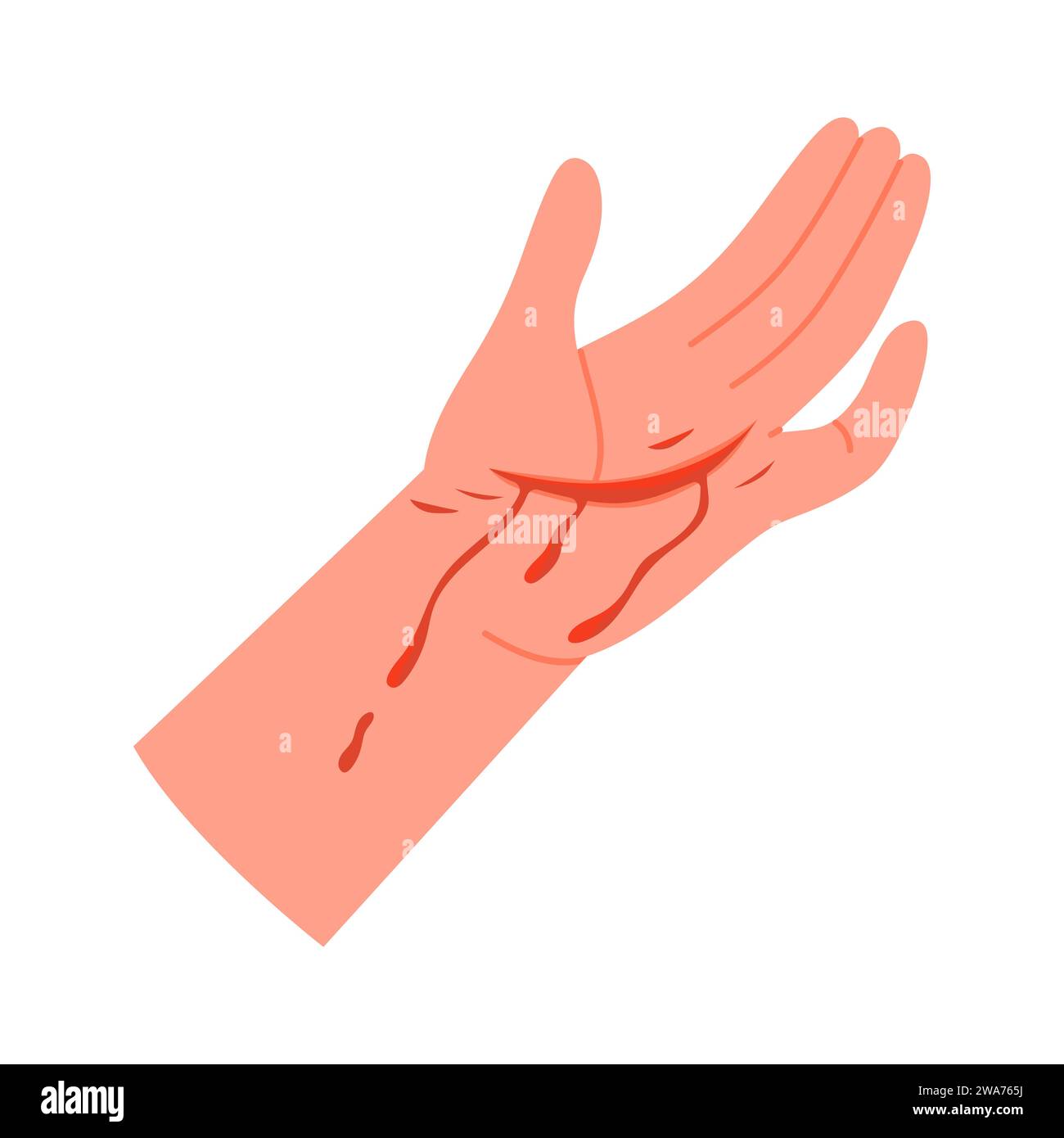 Bleeding cut on human hand. Injured hand with blood, first medical aid ...