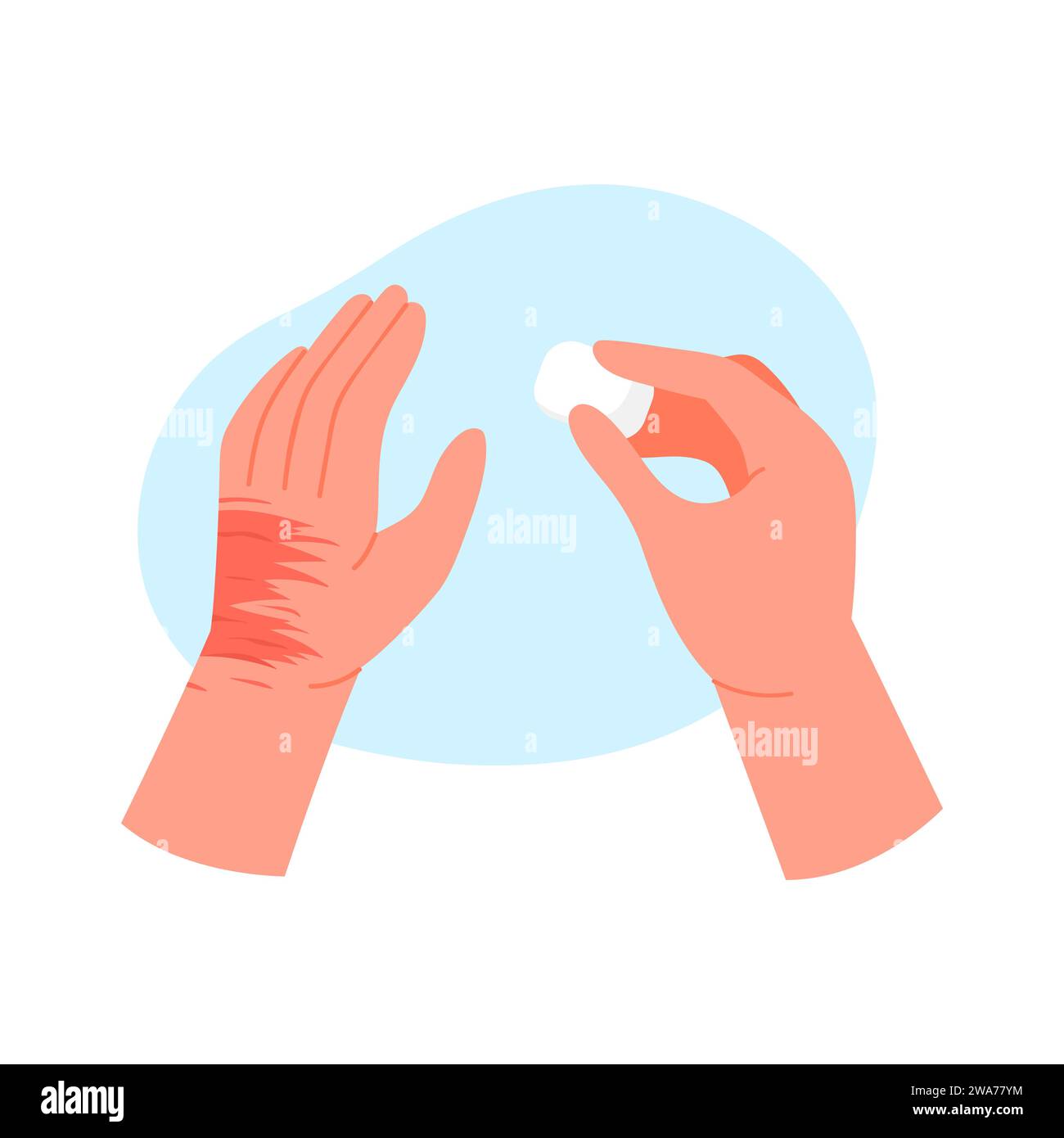 Disinfect injury on human hand. First medical aid for body wound ...