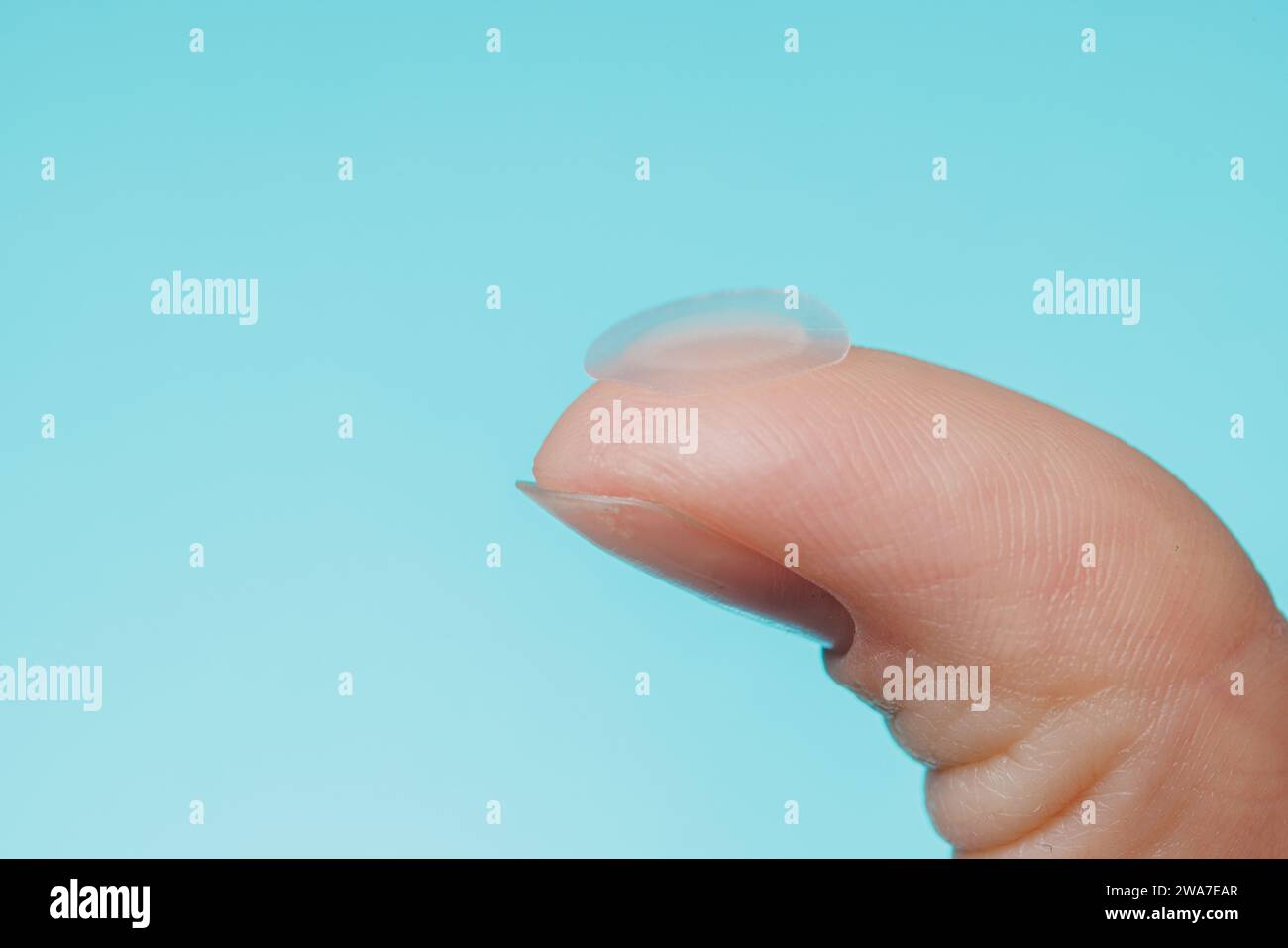 Close-up round acne patch on finger on blue background. Acne patches ...