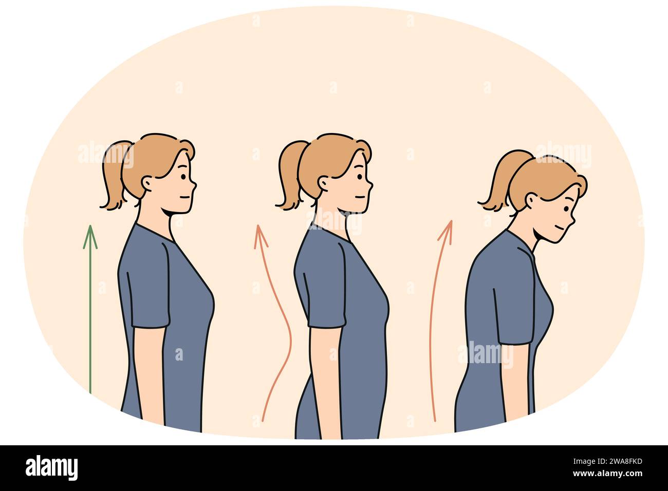 Set of young woman posture correction. Collection of female with and ...