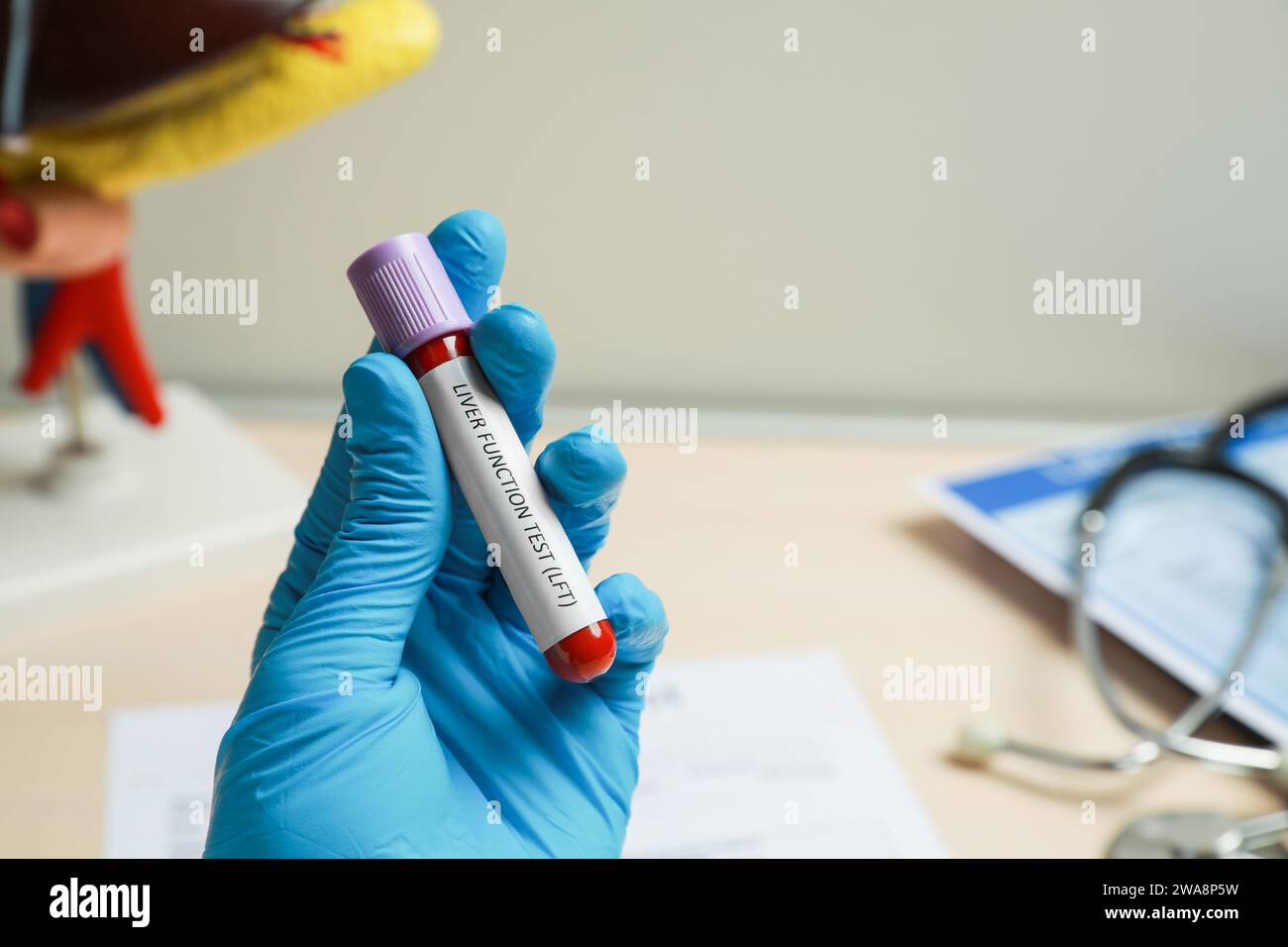 Laboratory worker holding tube with blood sample and label Liver ...