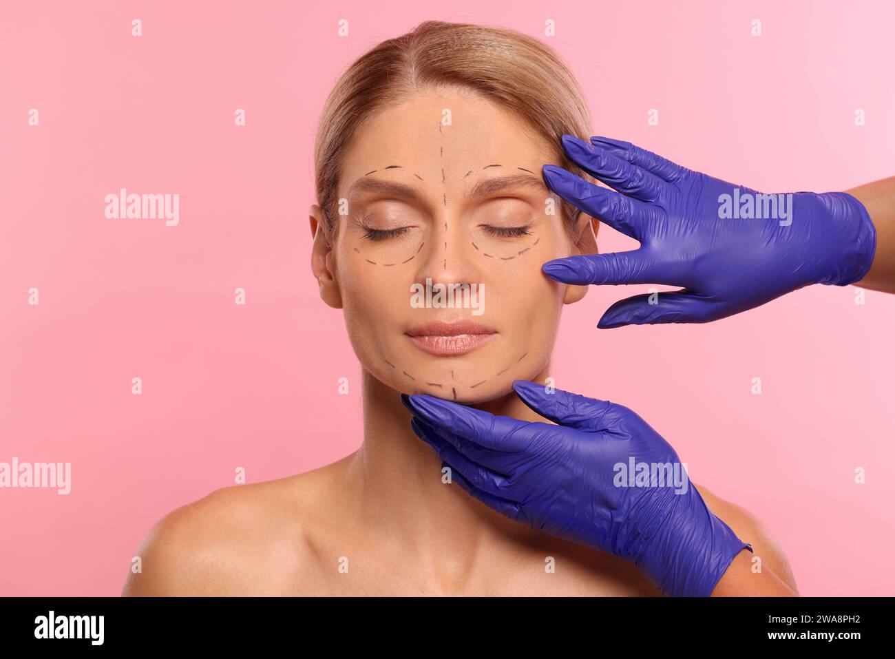 Doctor checking patients skin hi-res stock photography and images - Alamy