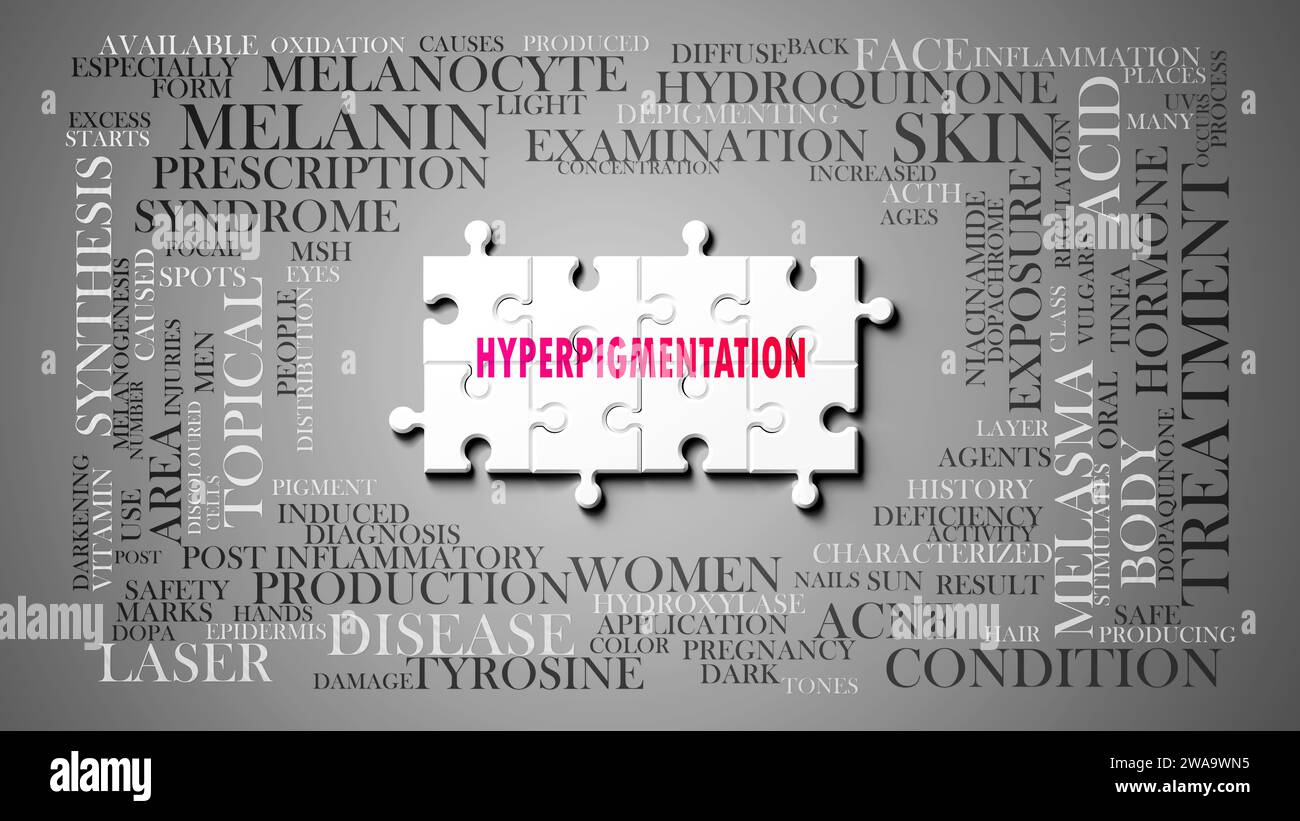 Hyperpigmentation - a complex subject, related to many concepts. Pictured as a puzzle and a word ...