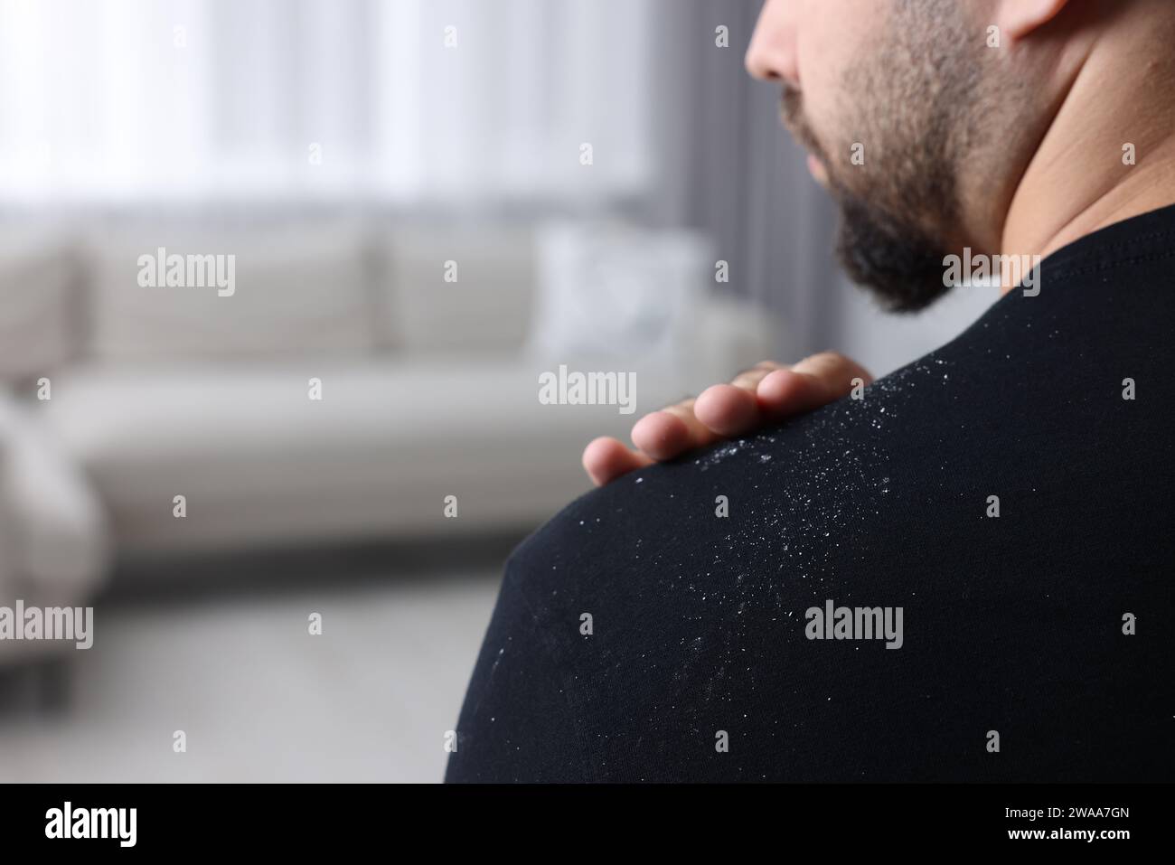 Man brushing dandruff off hi-res stock photography and images - Alamy