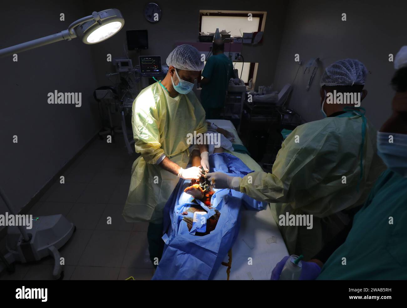 Paletinian doctors performs complex surgeries on injured Palestinians ...