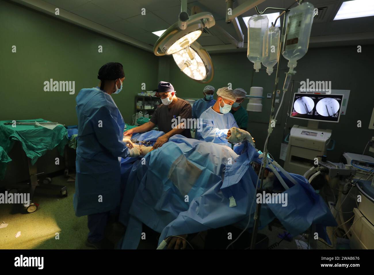 Paletinian doctors performs complex surgeries on injured Palestinians ...