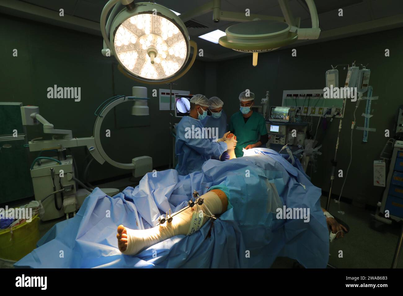 Paletinian doctors performs complex surgeries on injured Palestinians ...