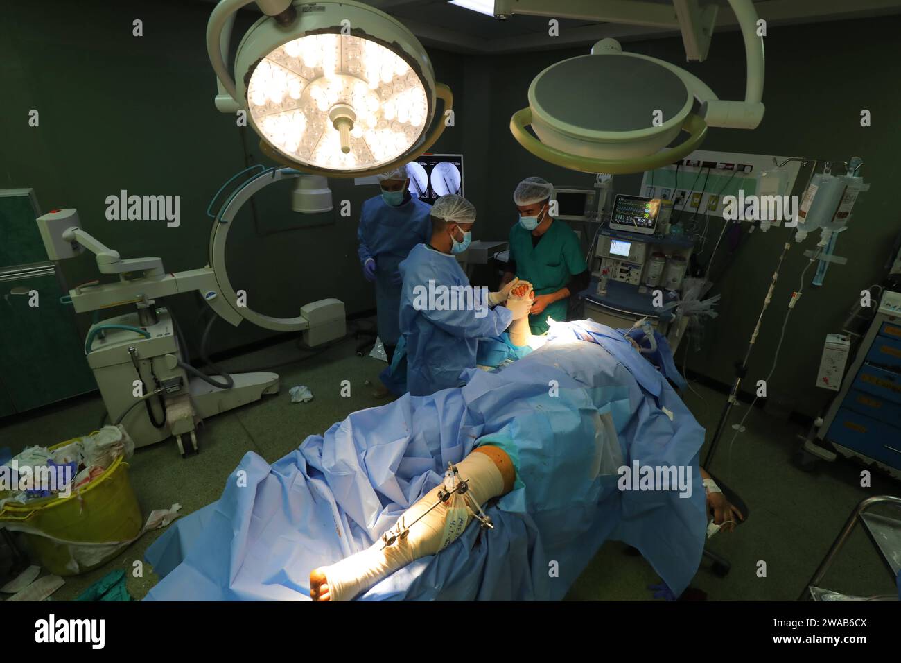 Paletinian doctors performs complex surgeries on injured Palestinians ...
